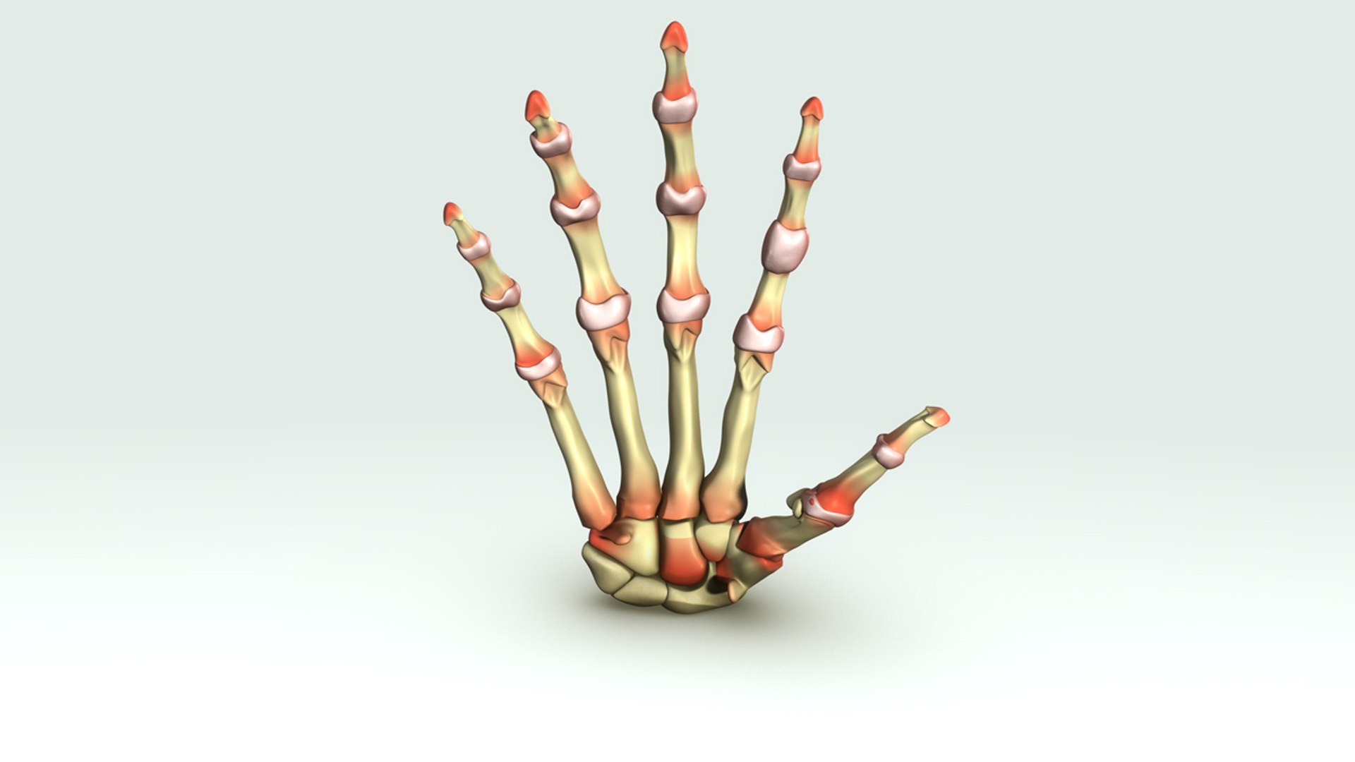 rheumatoid arthritis 3d model