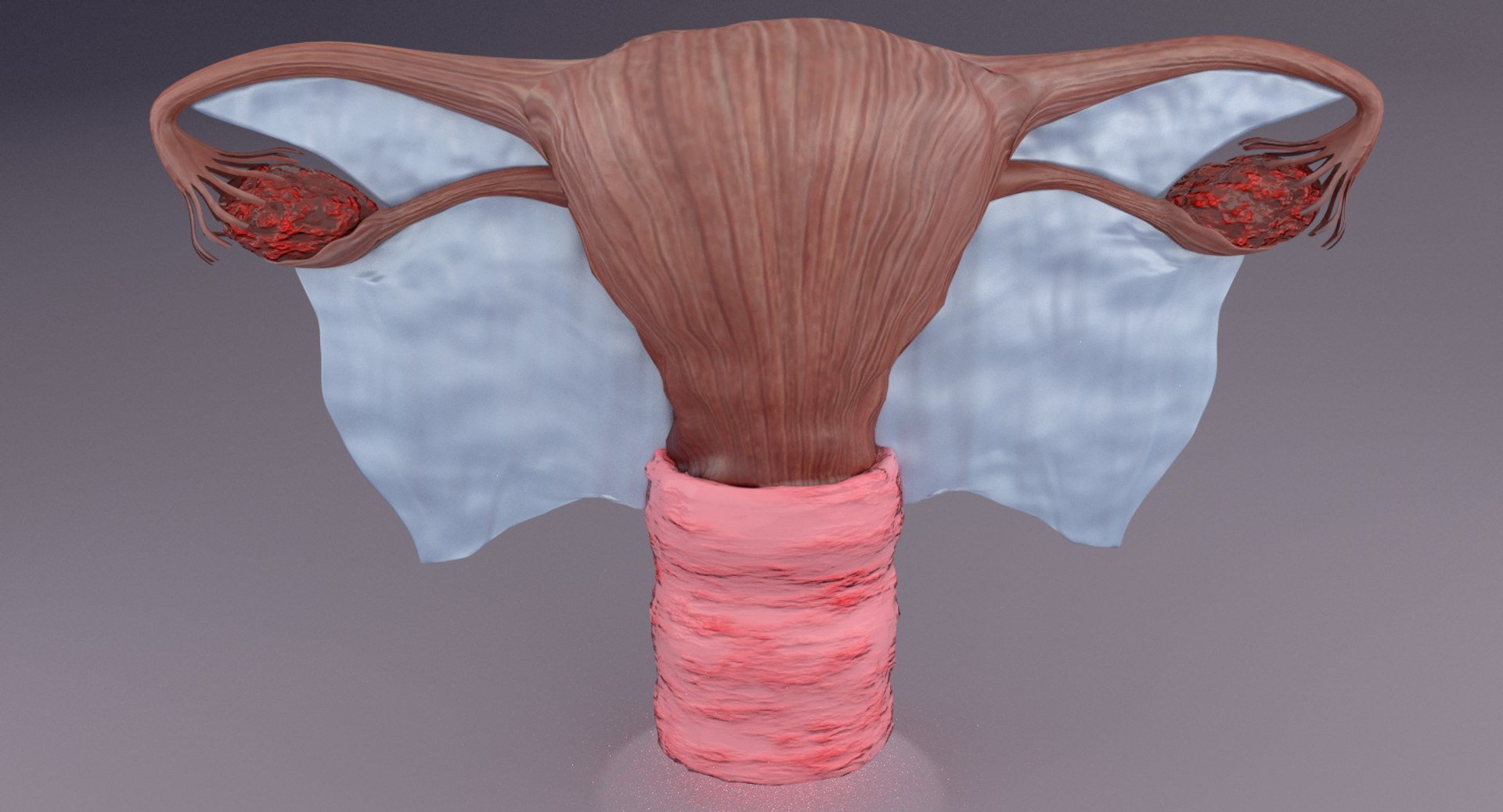Uterus Vagina Ovary 3D Model - TurboSquid 1320025