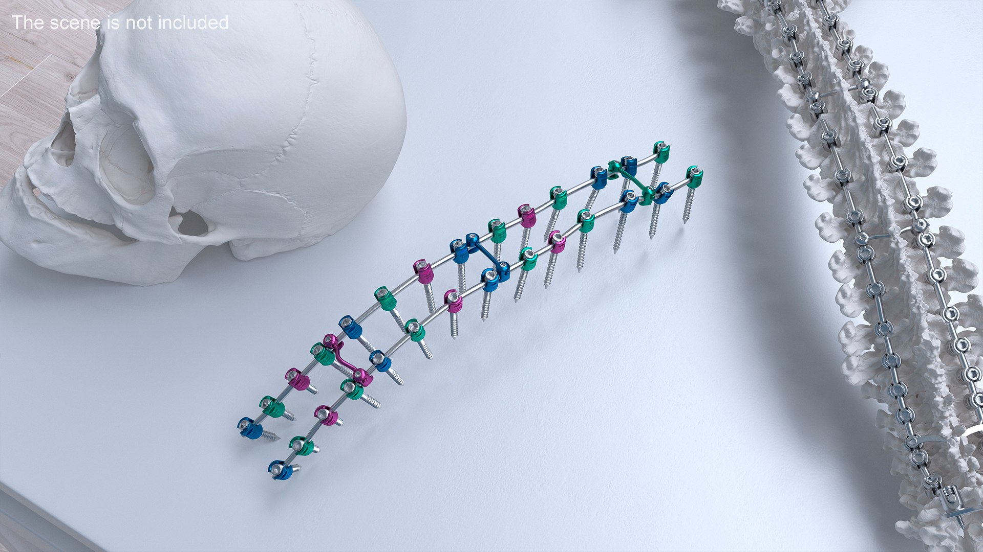 3D Model Thoracic Spine Fixation System Colored - TurboSquid 2205543