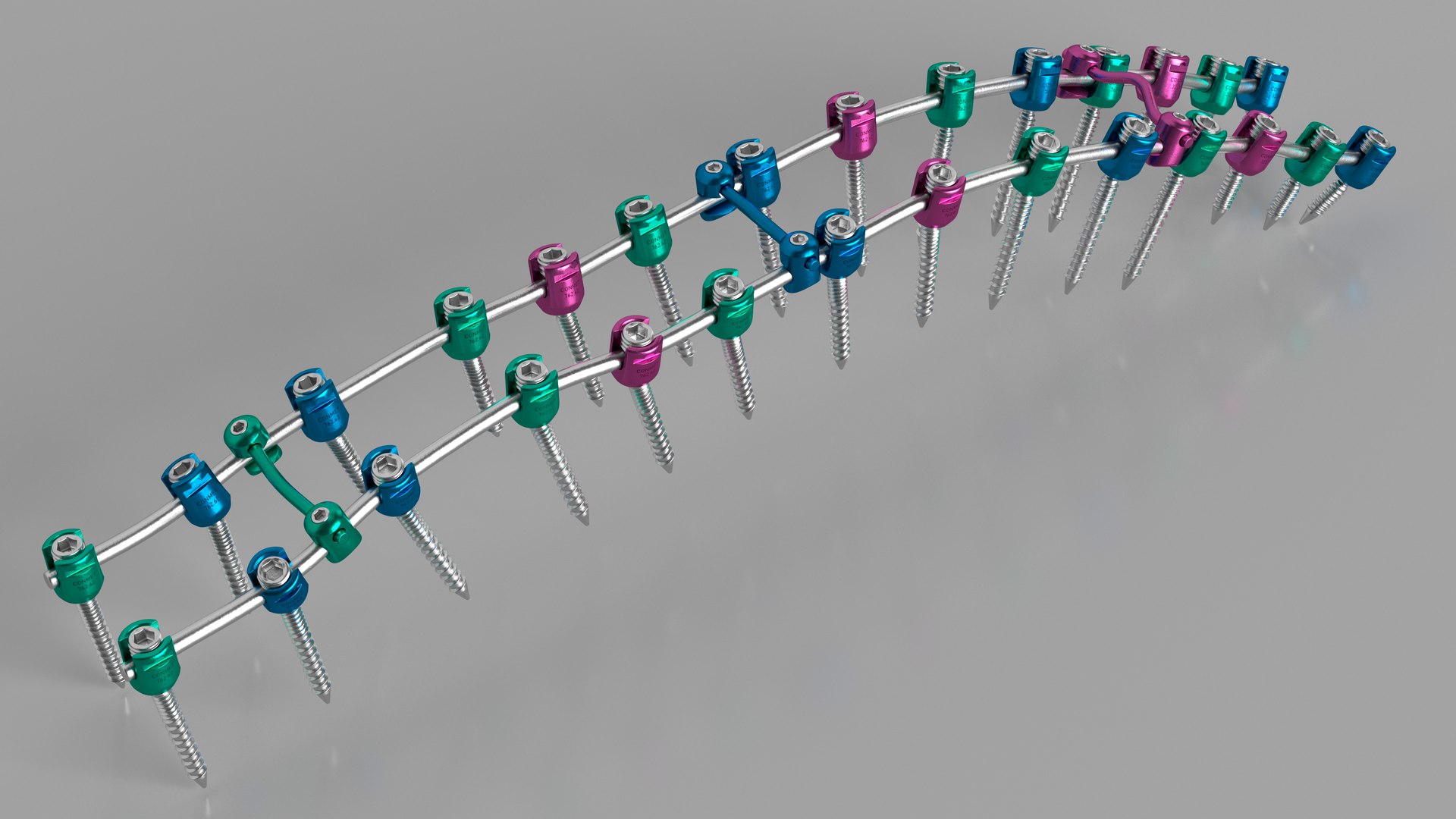 3D Model Thoracic Spine Fixation System Colored - TurboSquid 2205543