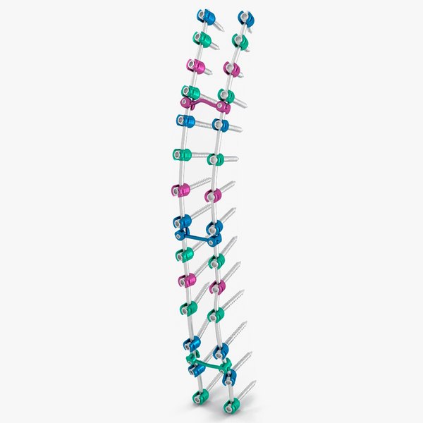 modelo 3d Sistema de fijación de la columna torácica de color ...