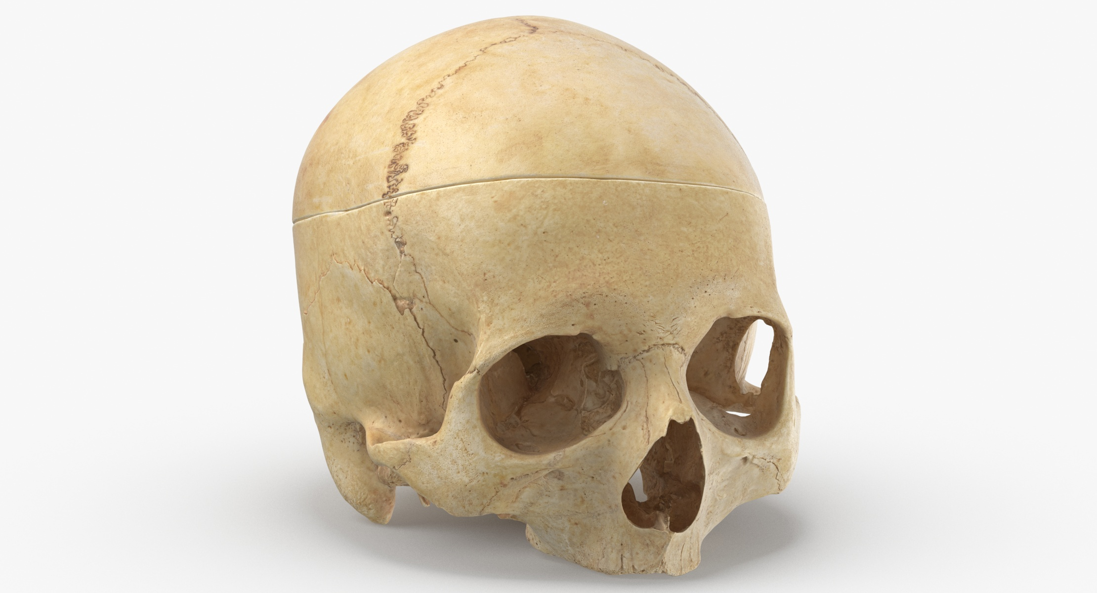 modelo 3d Cráneo humano real Cranial 02 cortado con pieza - TurboSquid ...