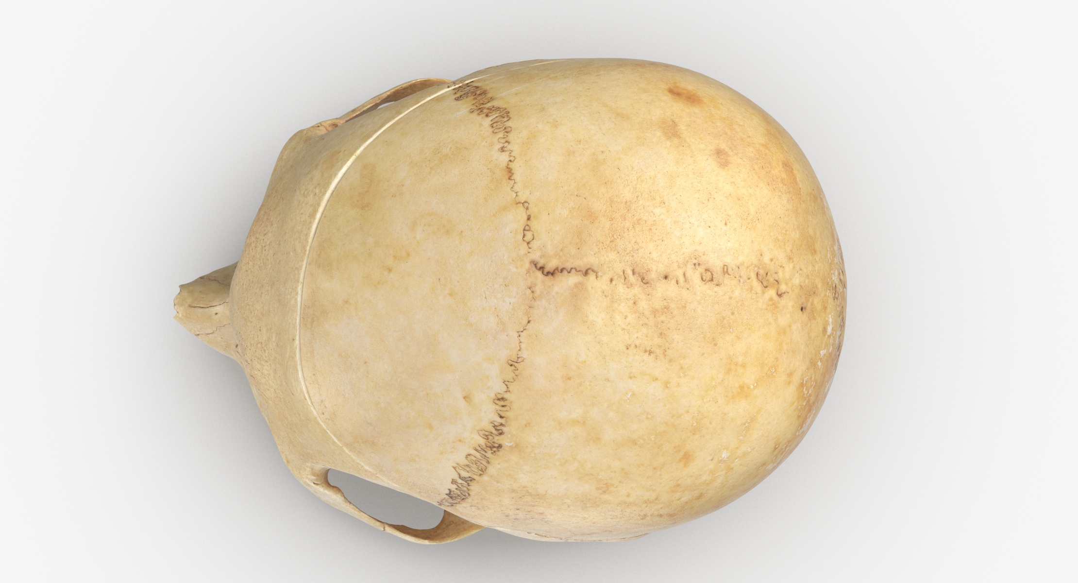 modelo 3d Cráneo humano real Cranial 02 cortado con pieza - TurboSquid ...