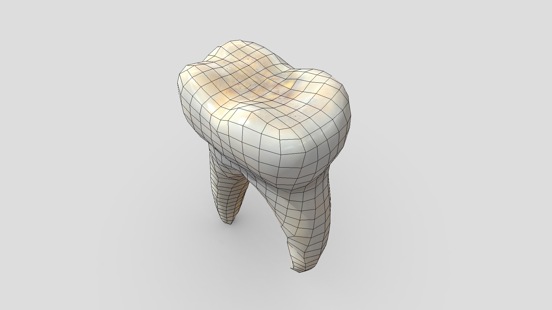 Human Tooth 3D Model - TurboSquid 2256451