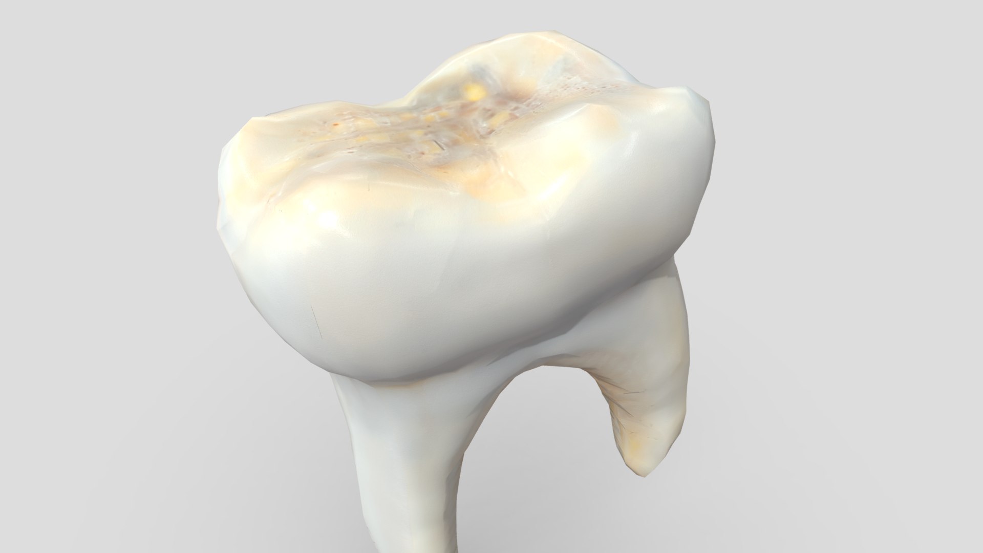 Human Tooth 3D Model - TurboSquid 2256451