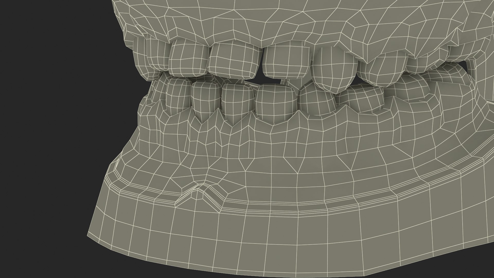 Dental Anatomy Educational Pediatric Kit with Removable Open Bite Teeth ...