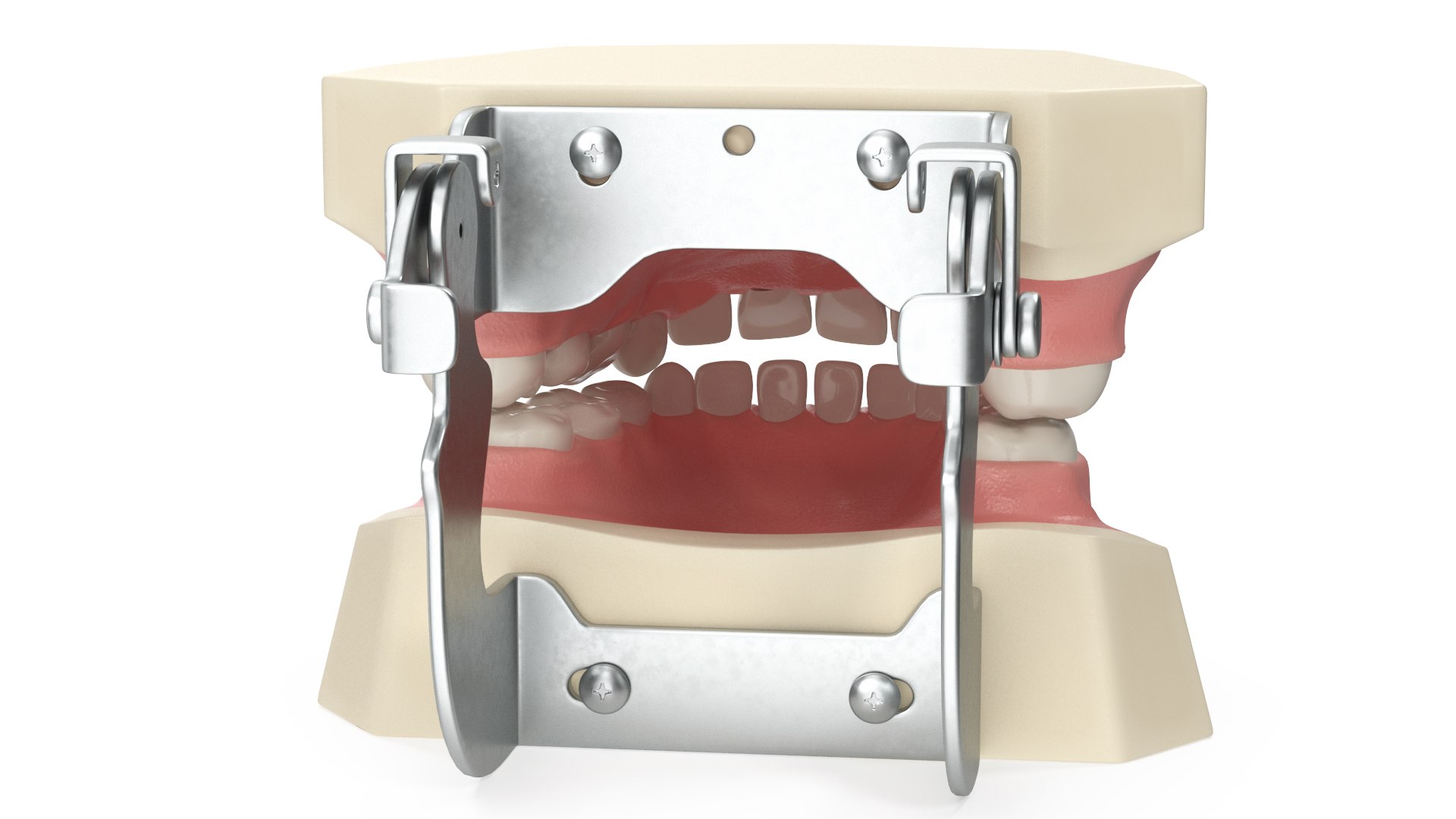 Dental Anatomy Educational Pediatric Kit With Removable Open Bite Teeth ...