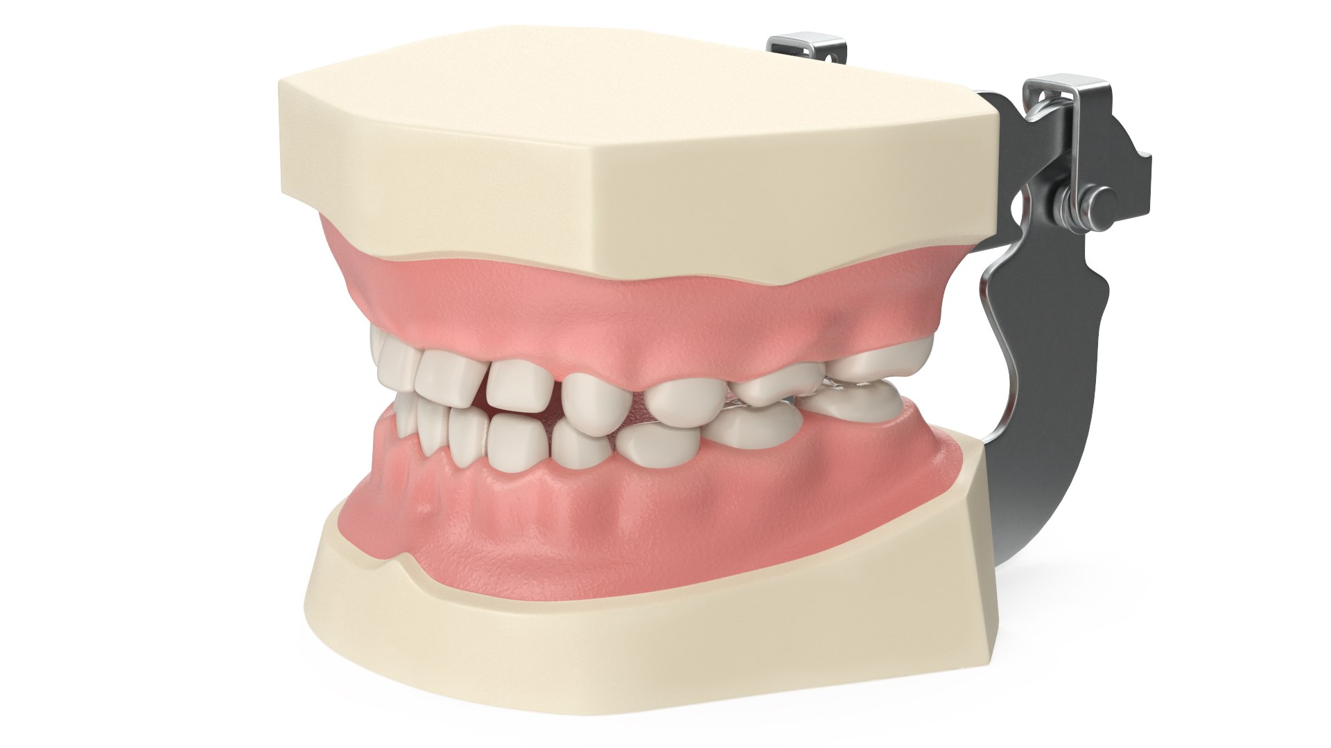 Dental Anatomy Educational Pediatric Kit with Removable Open Bite Teeth ...