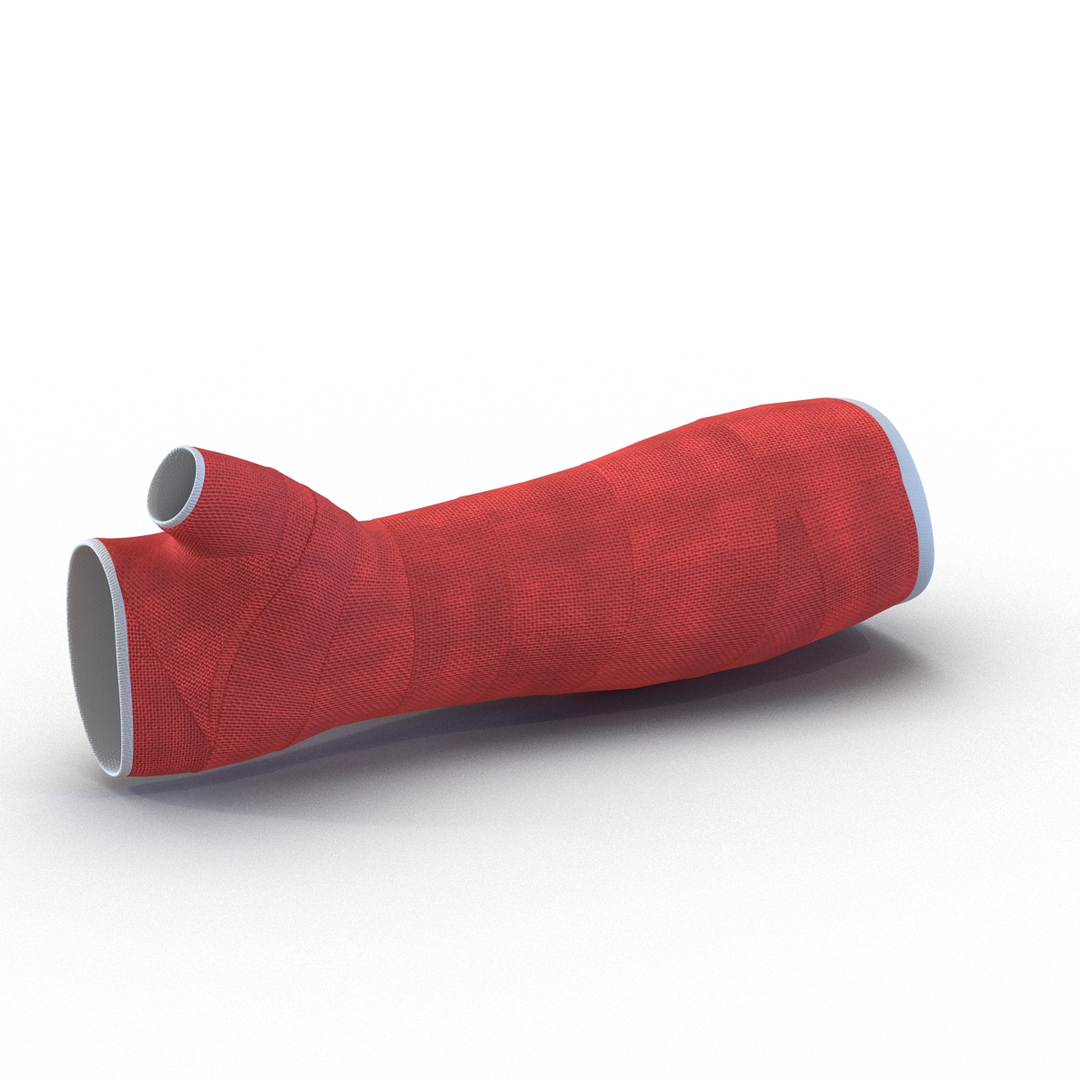 3D Orthopedic Casts Arm Collection - TurboSquid 2054836