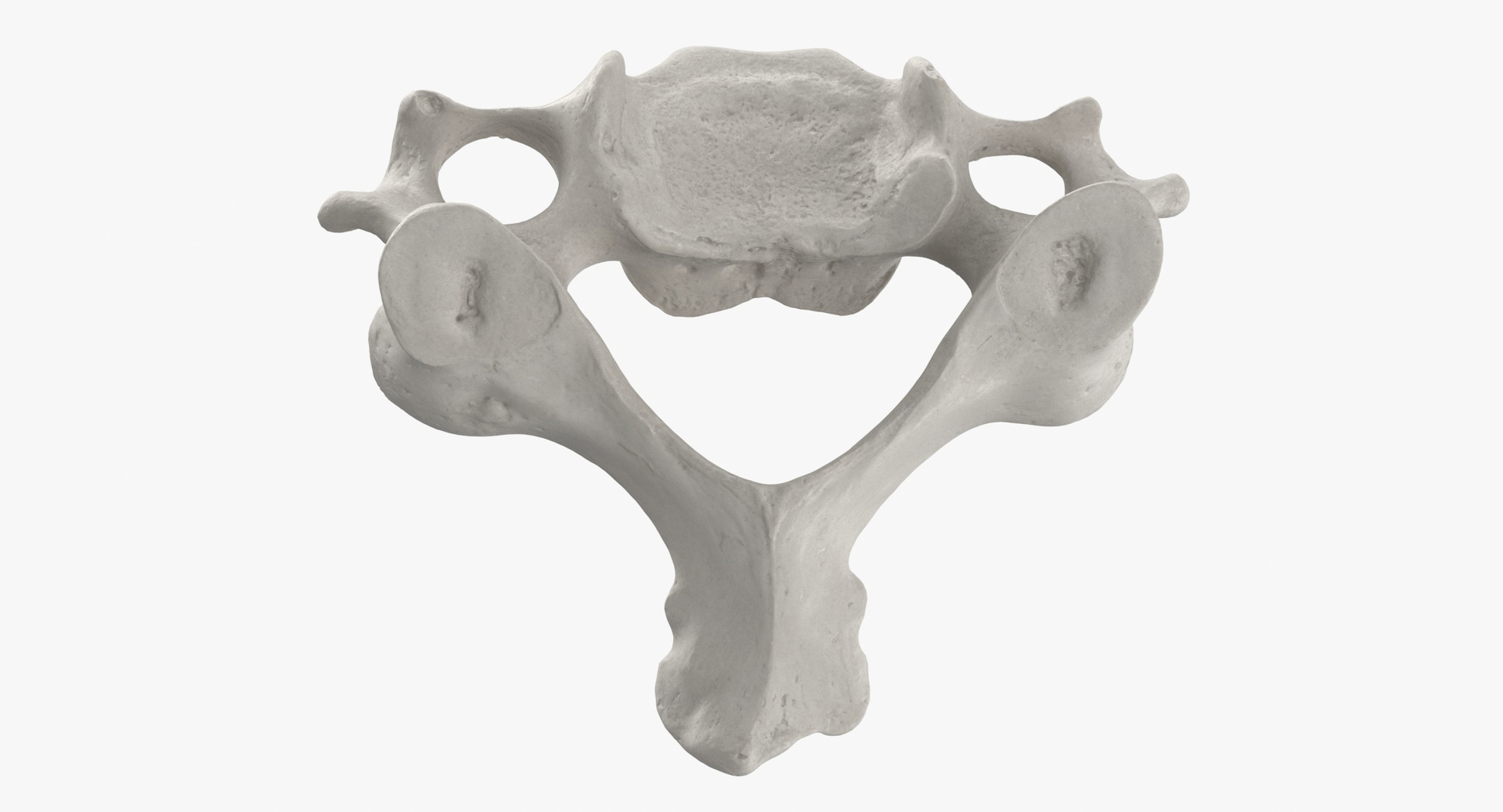 3D Cervical Vertebrae C3 C6 Model - TurboSquid 1567909