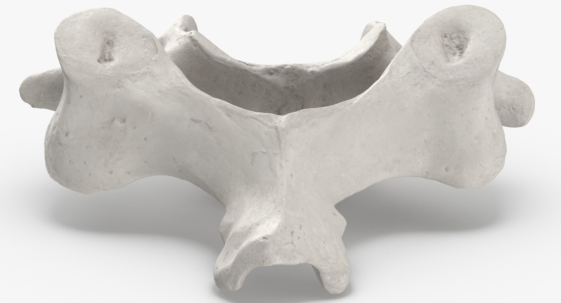 3D Cervical Vertebrae C3 C6 Model - TurboSquid 1567909