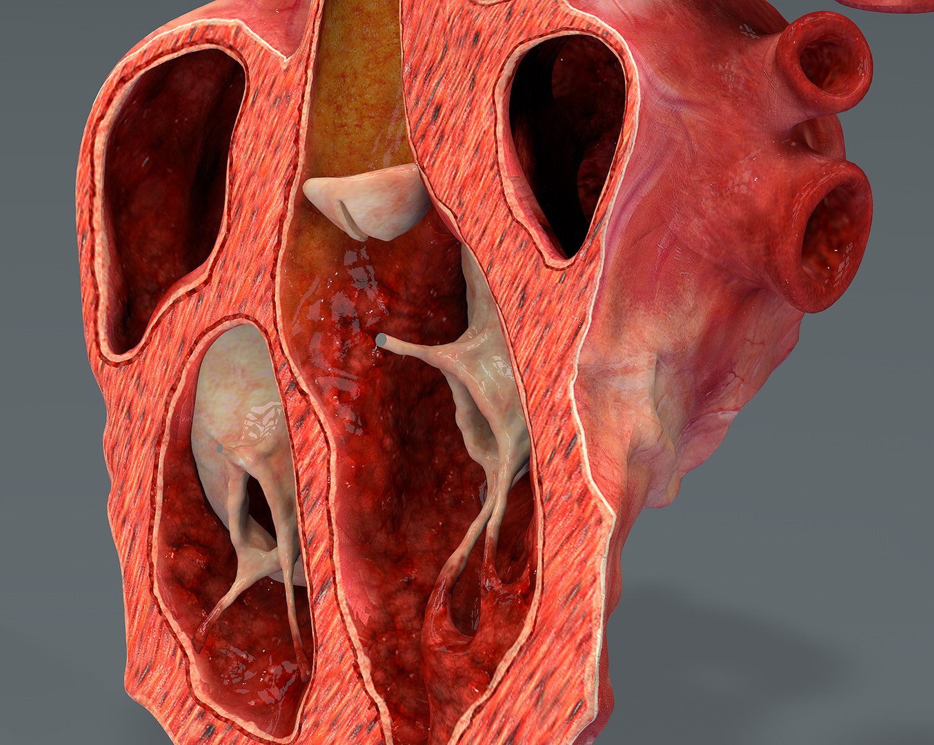 Open Heart 3D Model - TurboSquid 1408915