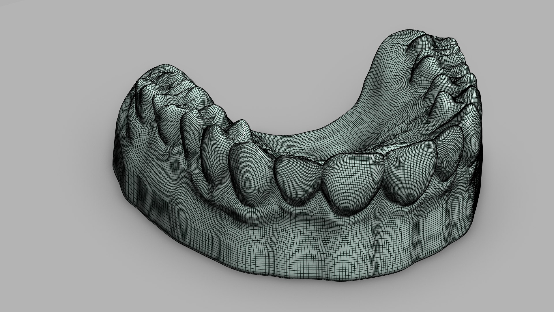 3D Dentures D Mold - TurboSquid 1810564