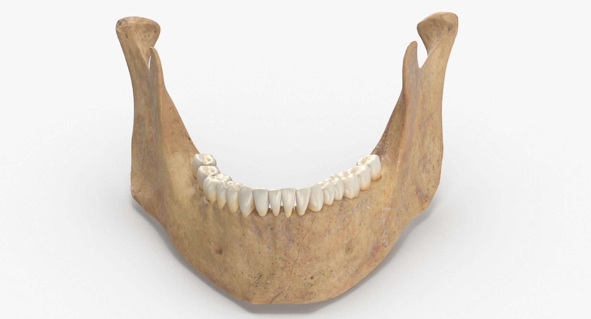 3D Human Male Jawbones With And Without Damages Collection Yellow - 3 ...