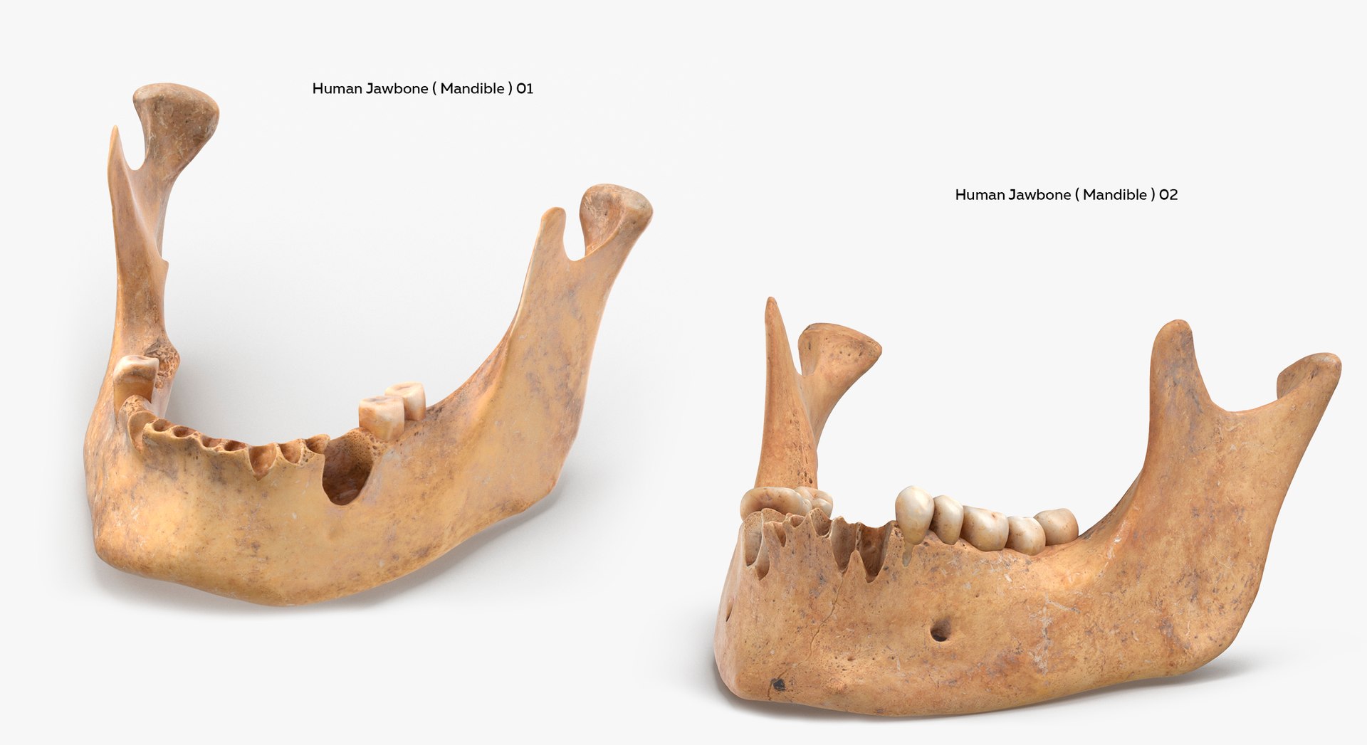 3D Human Male Jawbones With And Without Damages Collection Yellow - 3 ...
