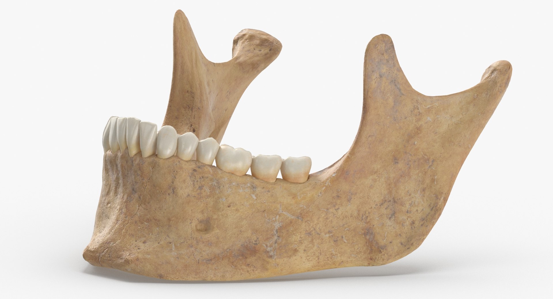 3D Human Male Jawbones With And Without Damages Collection Yellow - 3 ...