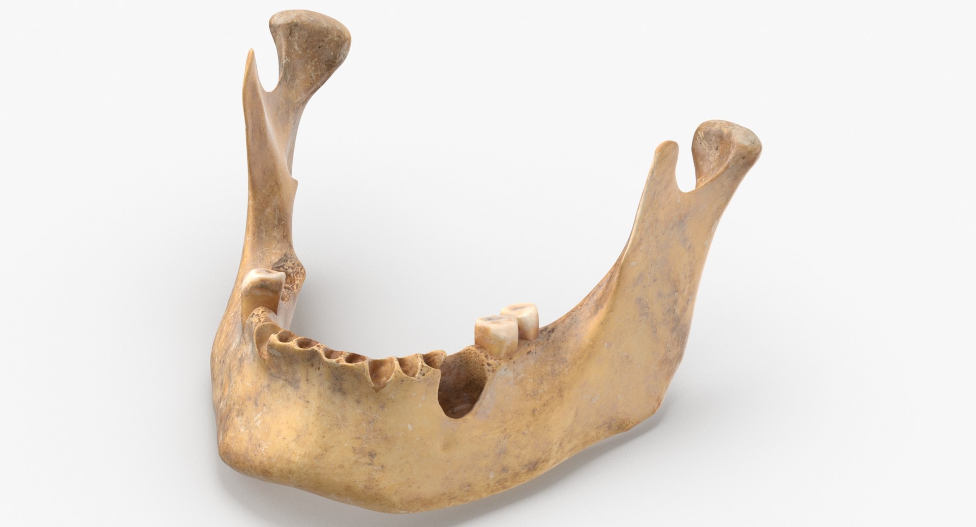 3D Human Male Jawbones With And Without Damages Collection Yellow - 3 ...