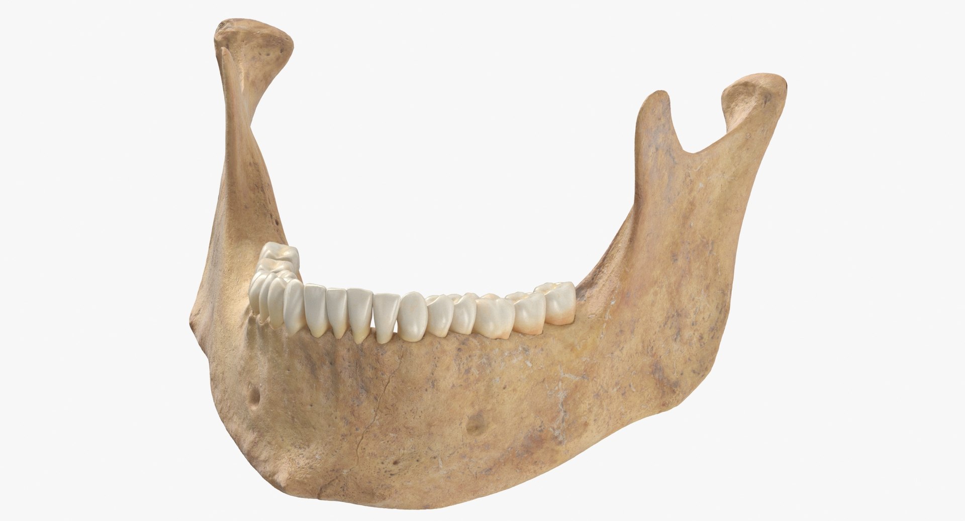 3D Human Male Jawbones With And Without Damages Collection Yellow - 3 ...