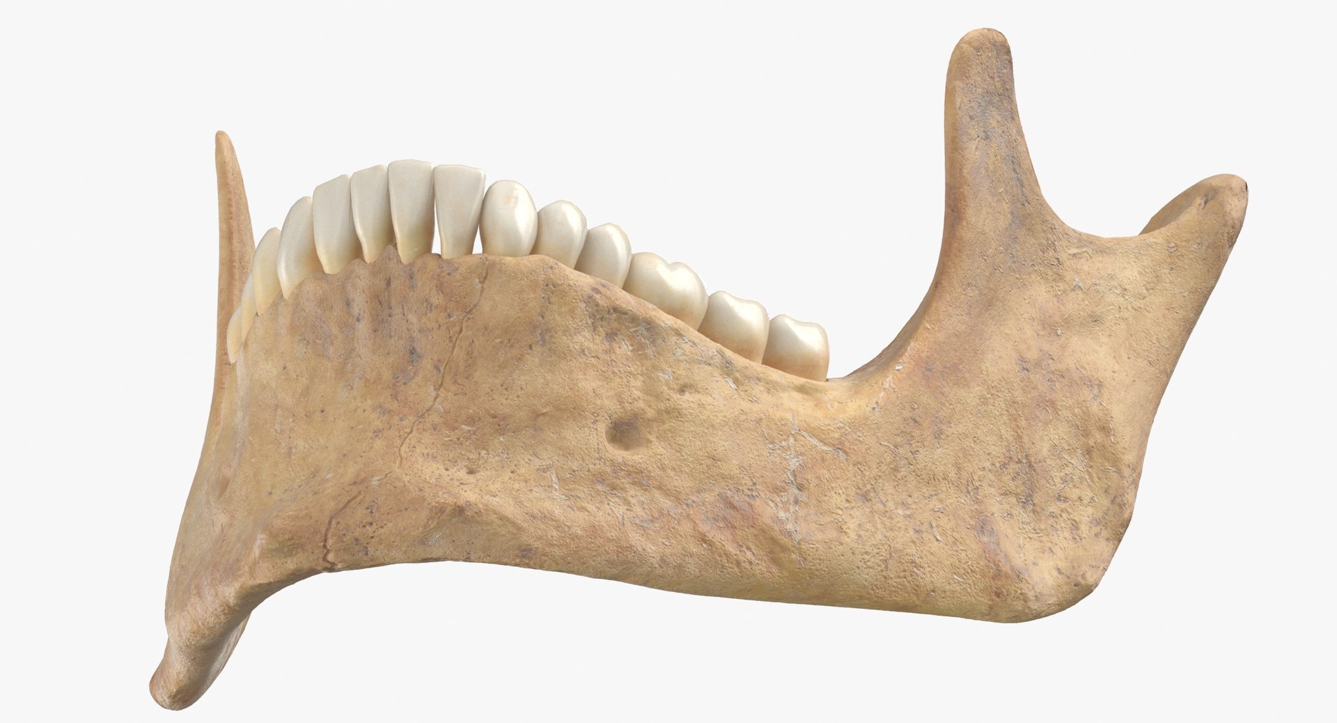 3D Human Male Jawbones With And Without Damages Collection Yellow - 3 ...