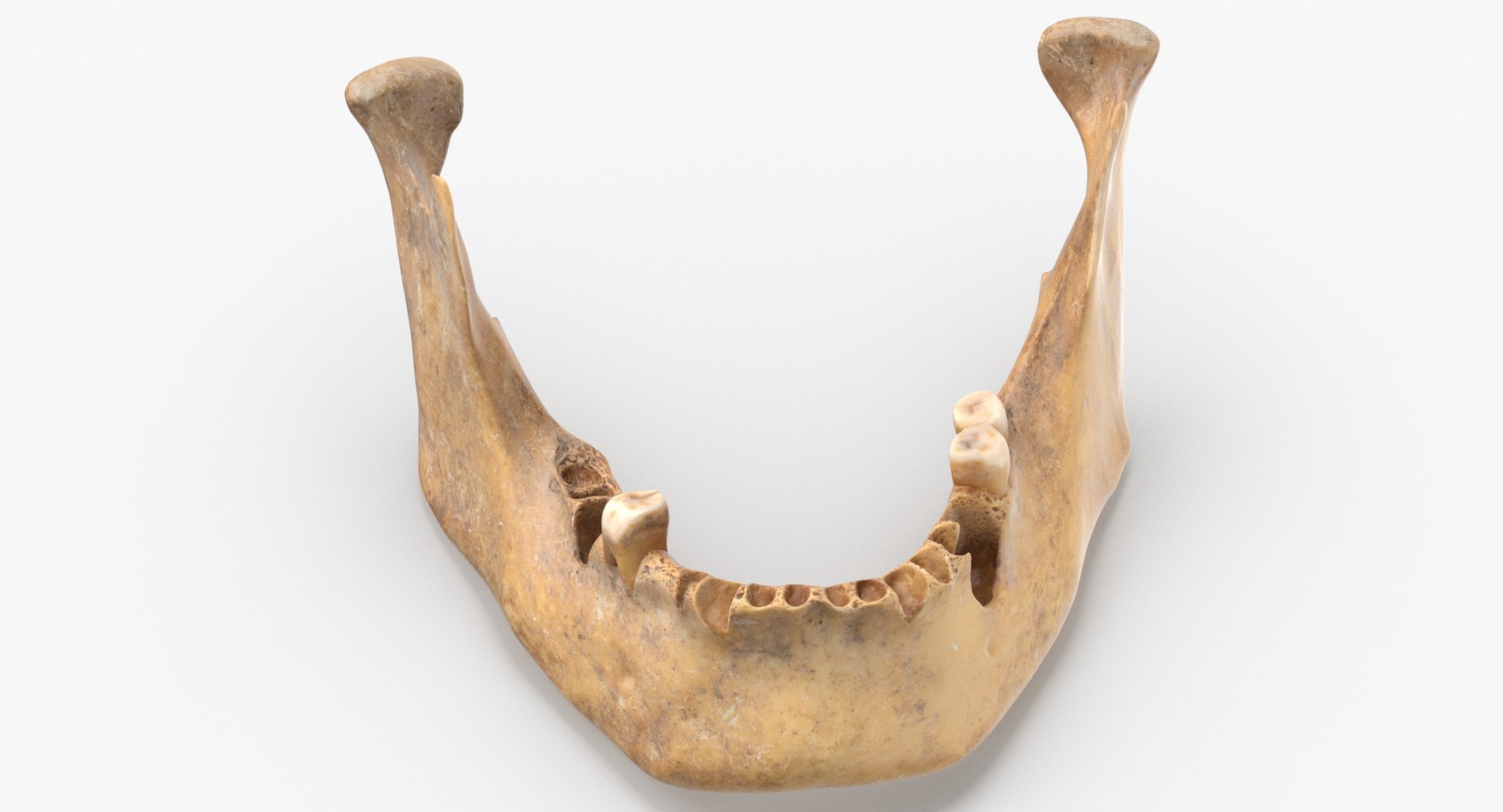 3D Human Male Jawbones With And Without Damages Collection Yellow - 3 ...