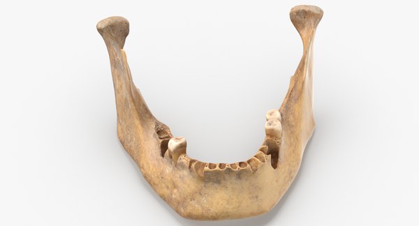 3D Human Male Jawbones With And Without Damages Collection Yellow - 3 ...
