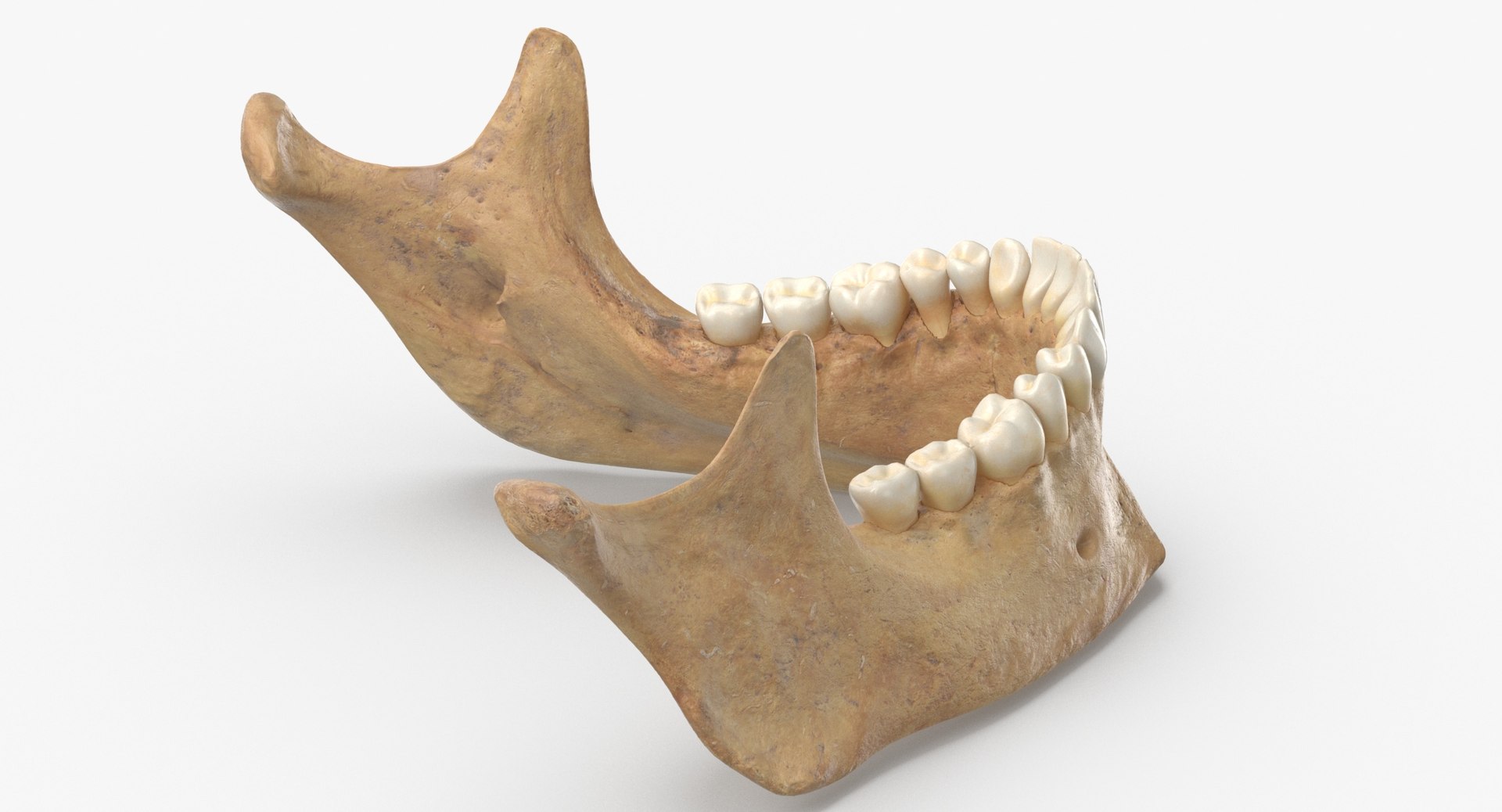 3D Human Male Jawbones With And Without Damages Collection Yellow - 3 ...