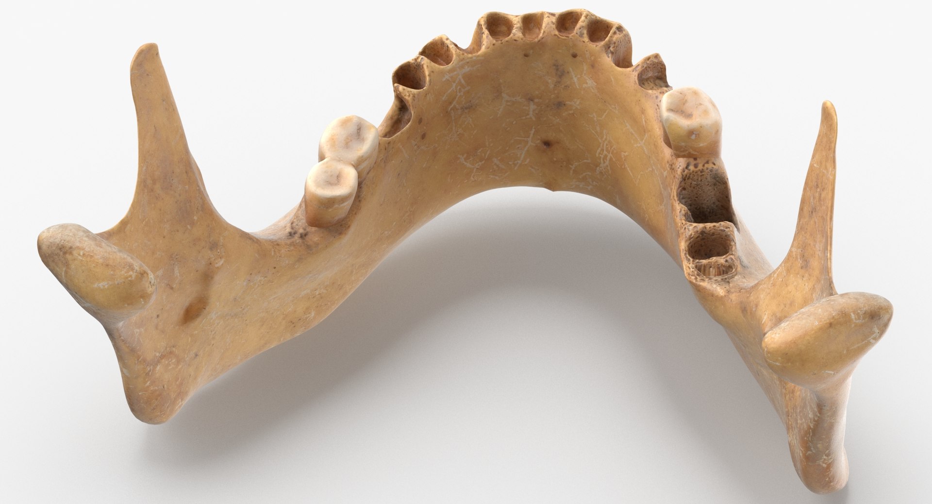 3D Human Male Jawbones With And Without Damages Collection Yellow - 3 ...