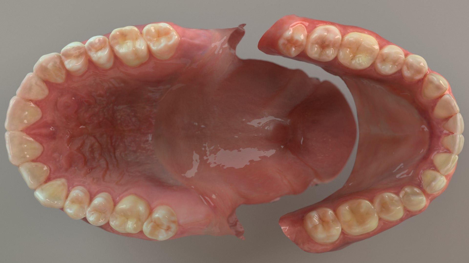 3D Model Dentures D - TurboSquid 1803744