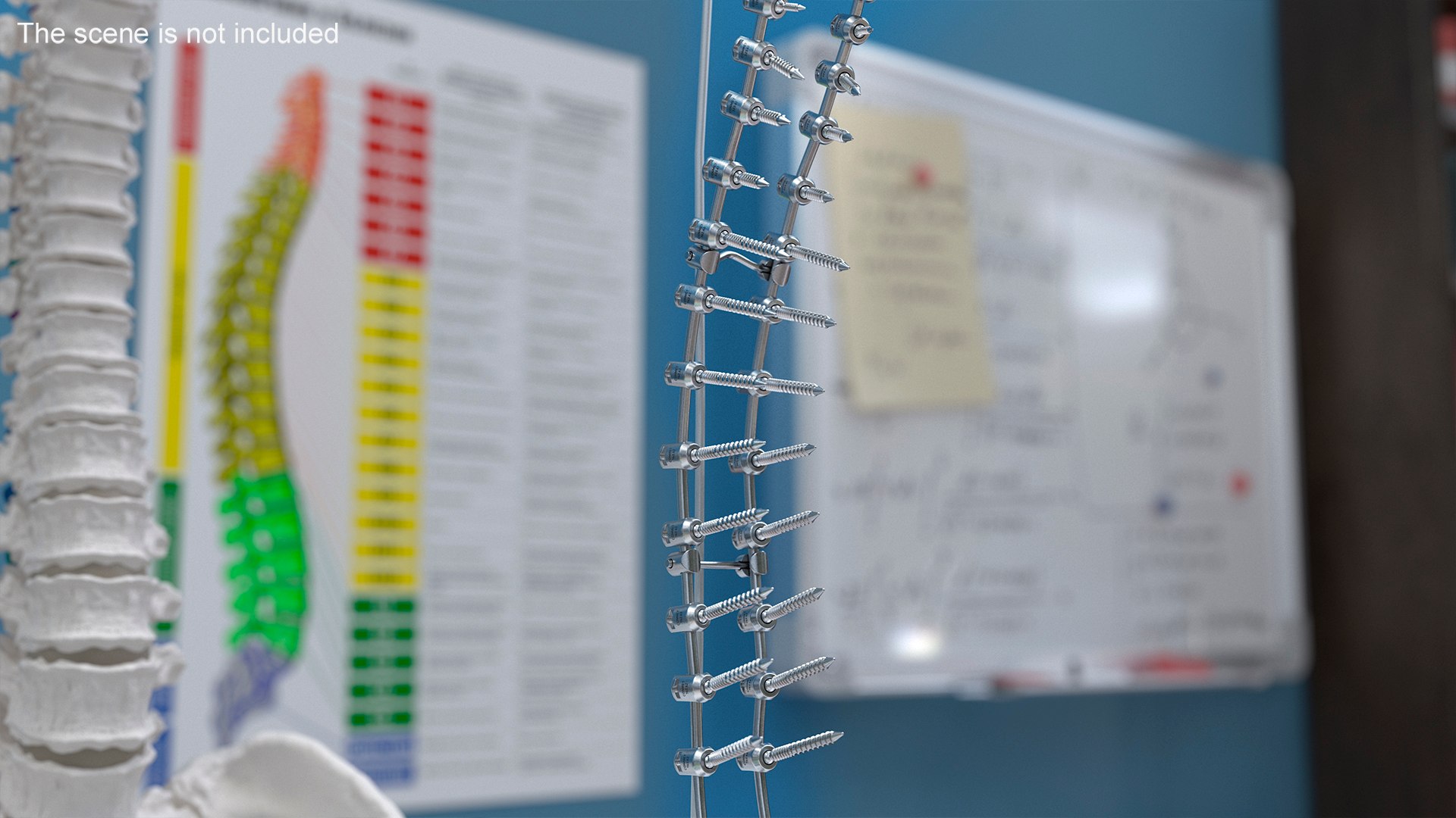 3D Model Spine Fixation System - TurboSquid 2205497