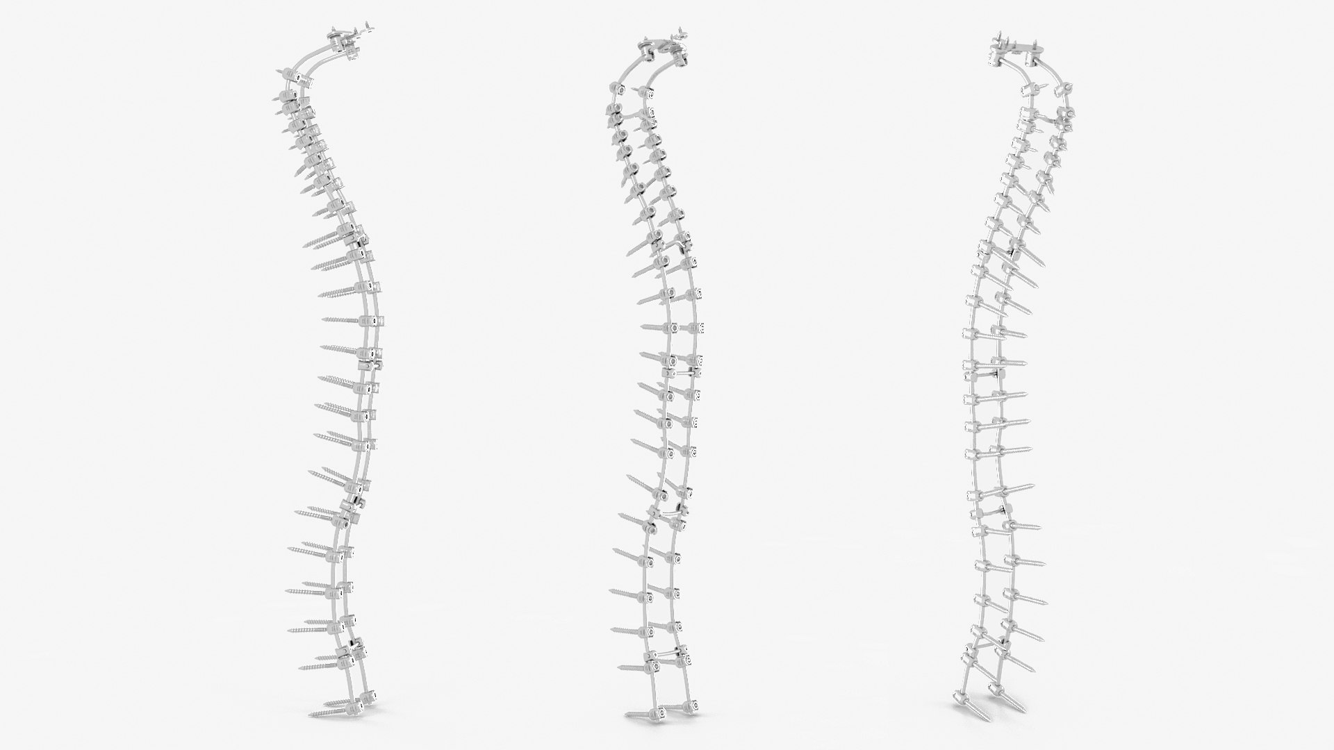 3D Model Spine Fixation System - TurboSquid 2205497