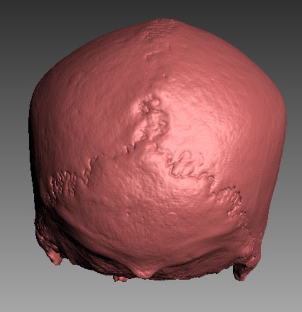 3D real human skull adult - TurboSquid 1335395