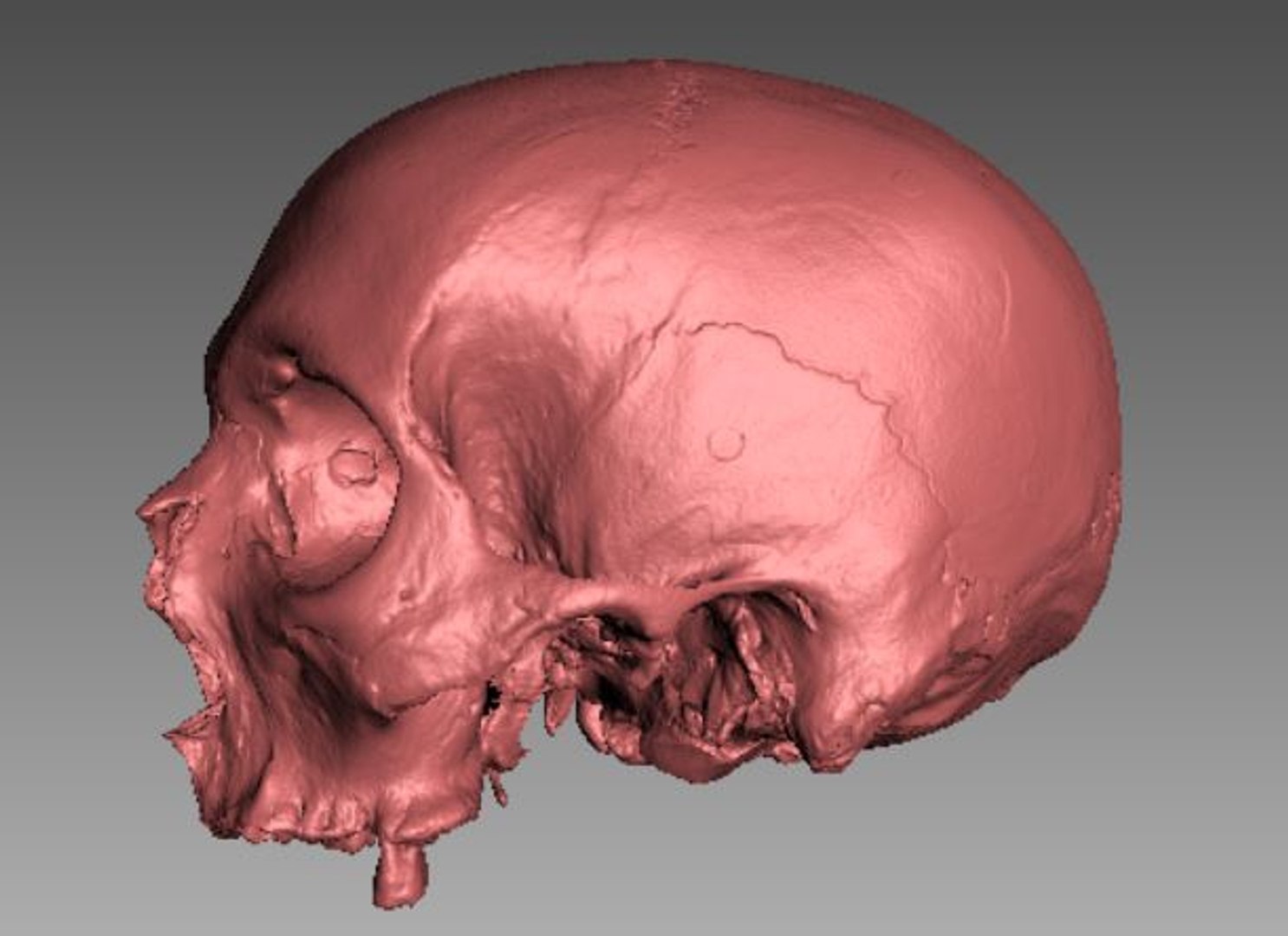 3D real human skull adult - TurboSquid 1335395