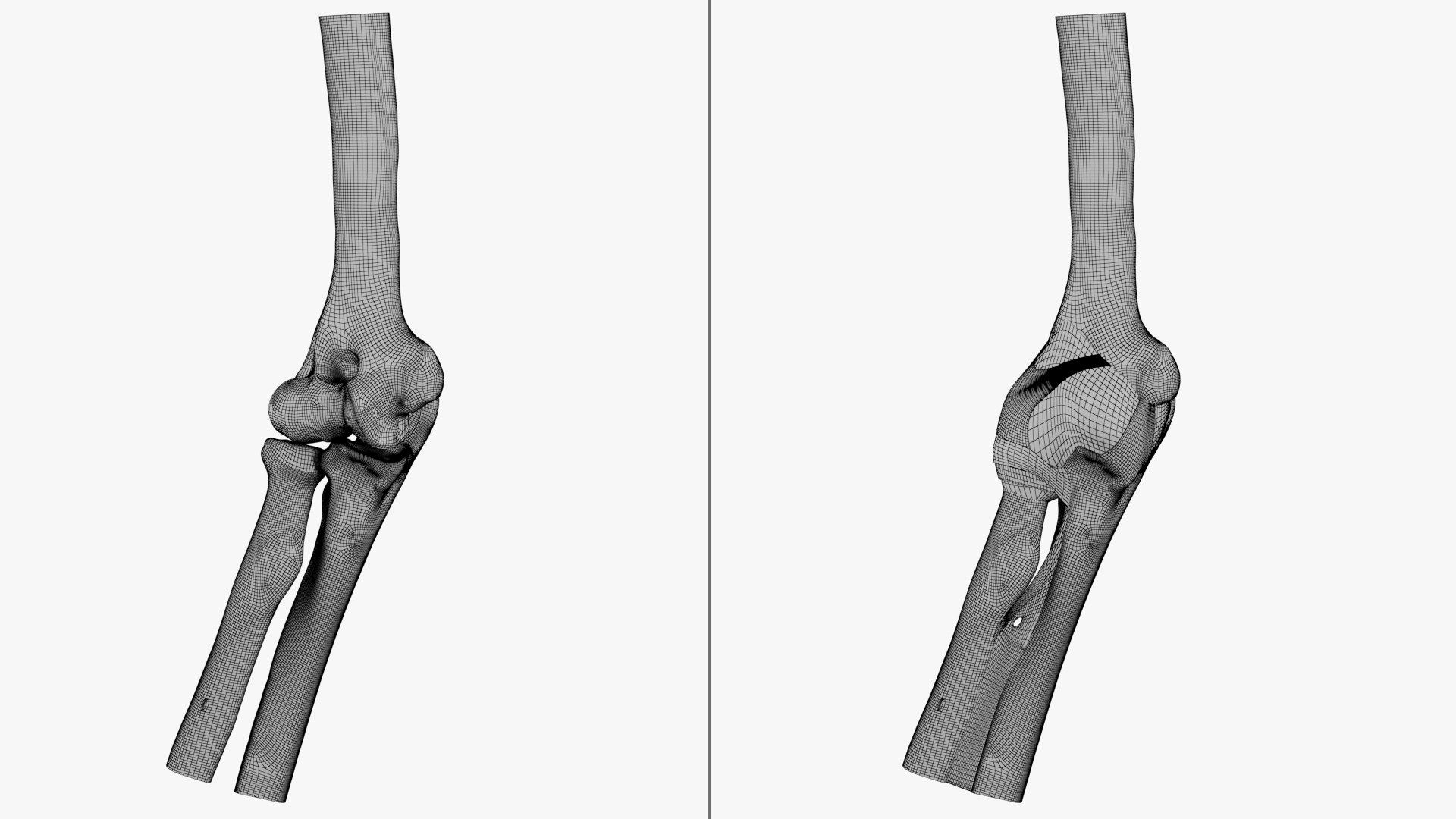3D Anatomy Of The Elbow Bones And Ligaments Model - TurboSquid 2219808
