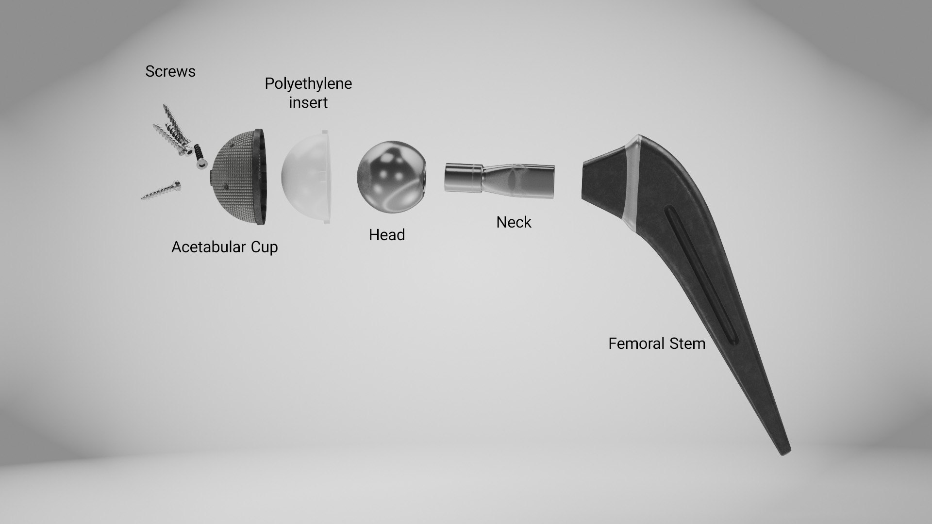 3D Hip Implant Model - TurboSquid 2133106