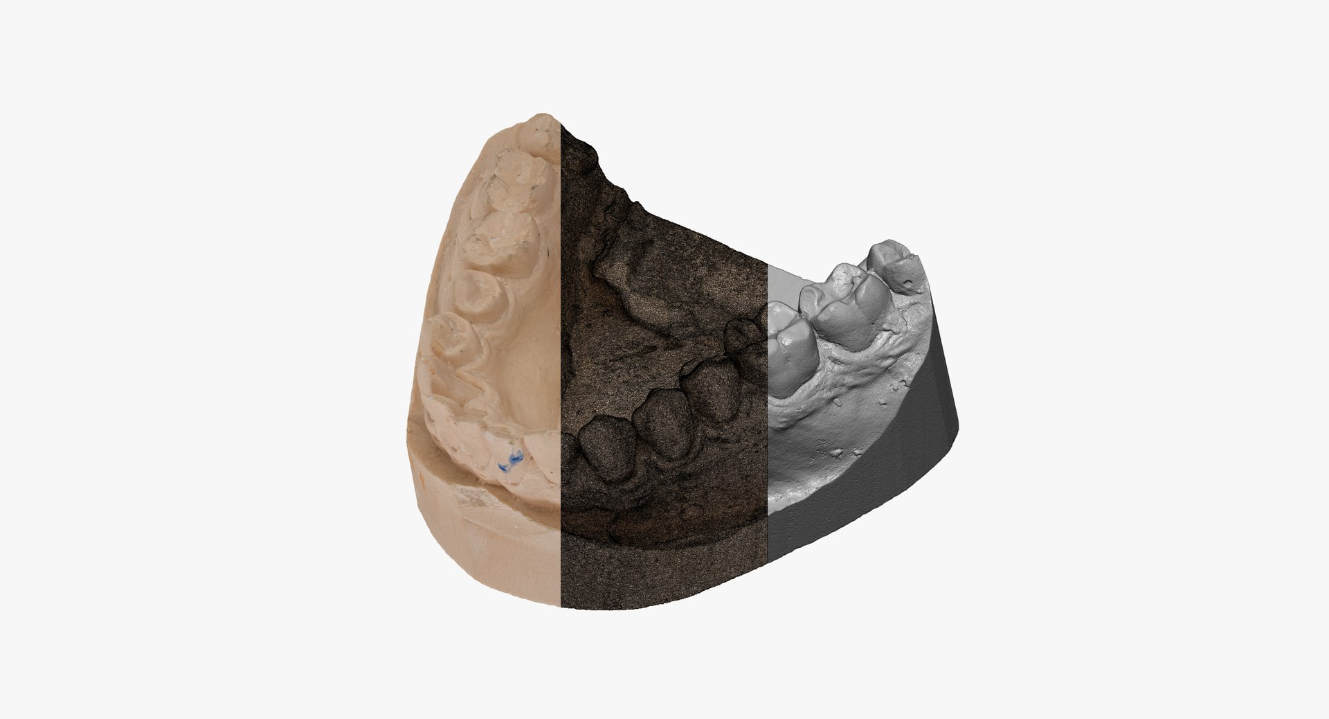 3D human lower jaw teeth - TurboSquid 1571610