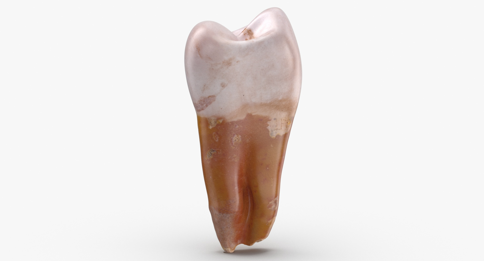 modelo 3d Colección de dientes limpios y dañados de premolares humanos ...