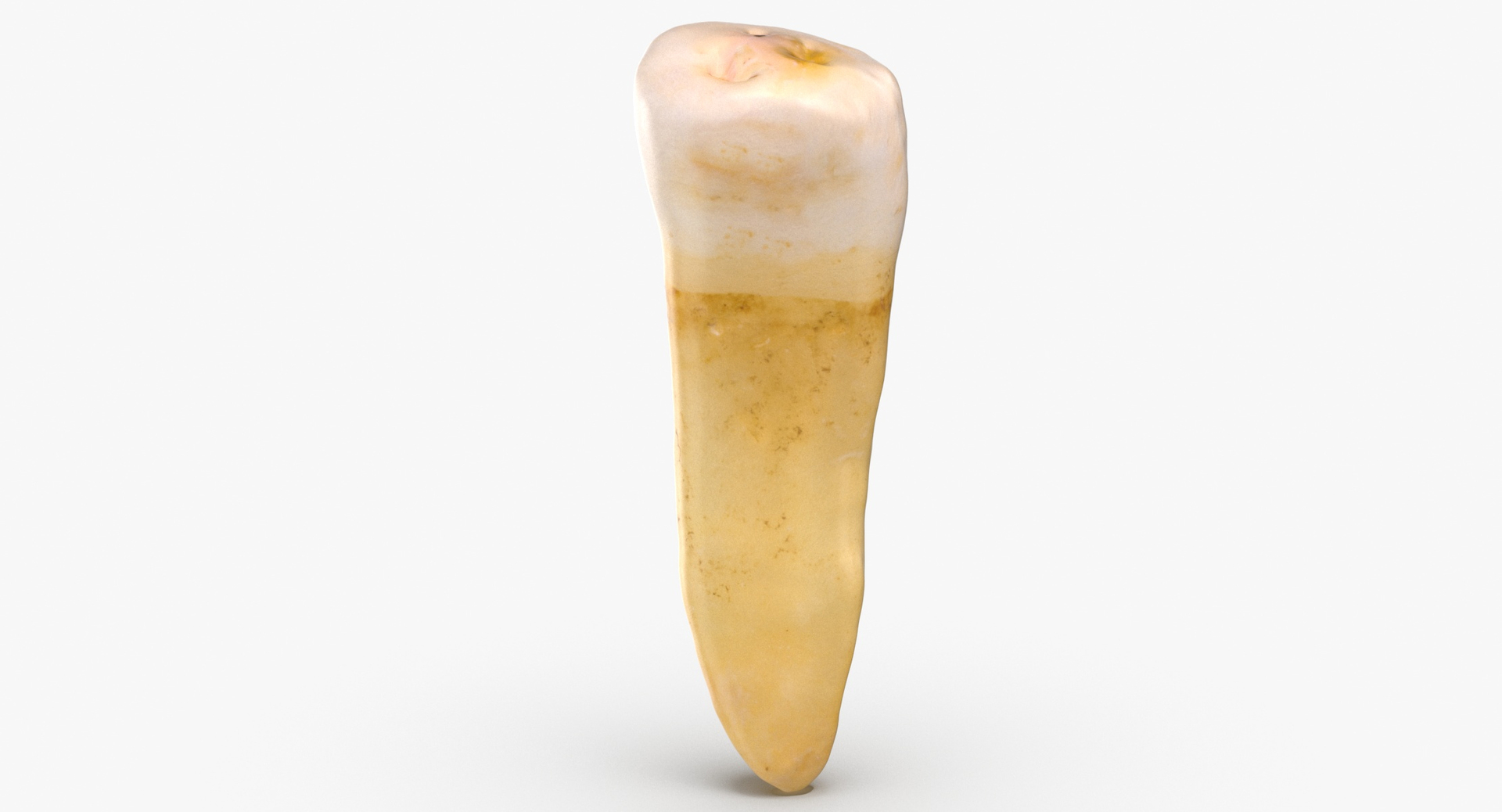 modelo 3d Colección de dientes limpios y dañados de premolares humanos ...