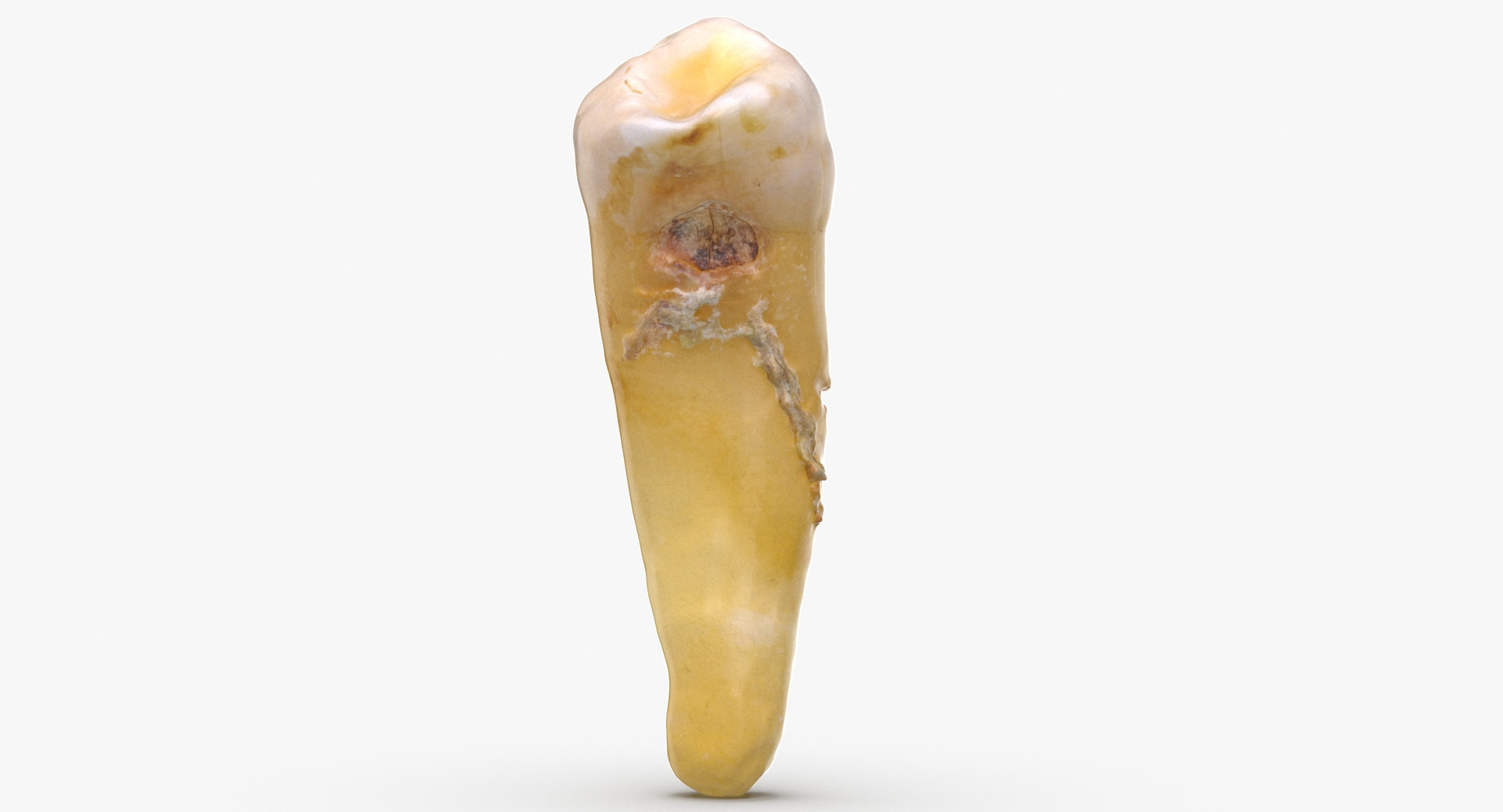 modelo 3d Colección de dientes limpios y dañados de premolares humanos ...