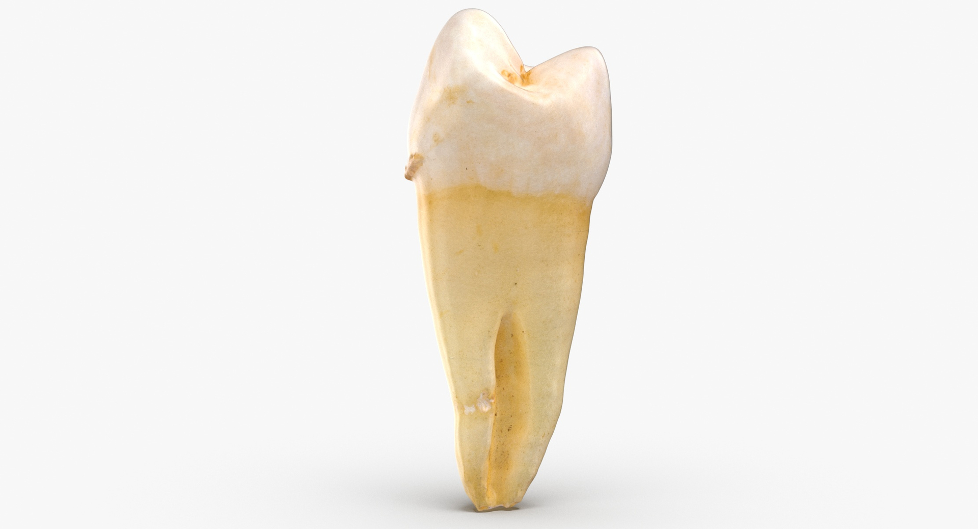 modelo 3d Colección de dientes limpios y dañados de premolares humanos ...