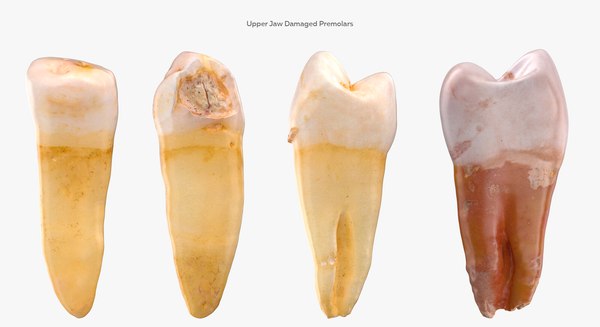 modelo 3d Colección de dientes limpios y dañados de premolares humanos ...