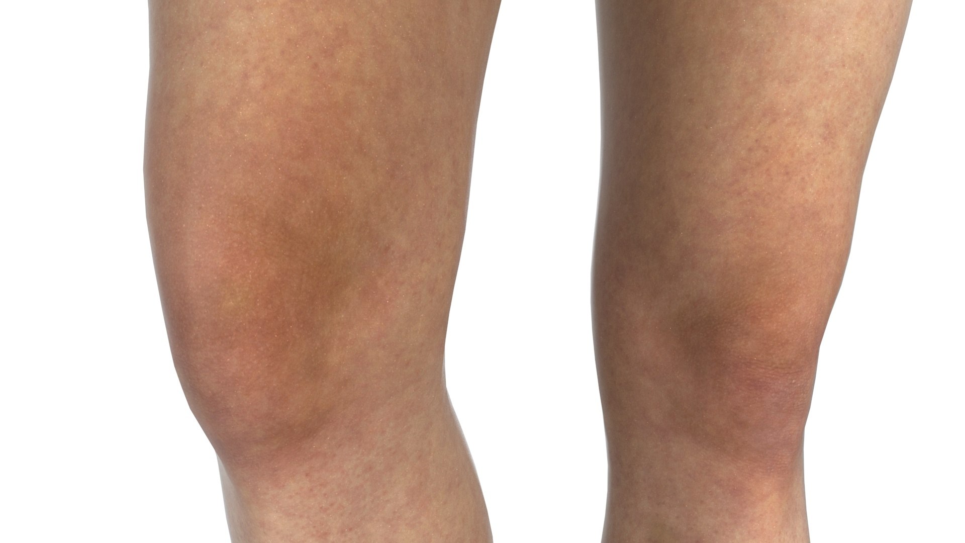 Realistic Female Lower Legs And Feet 3D - TurboSquid 2274486