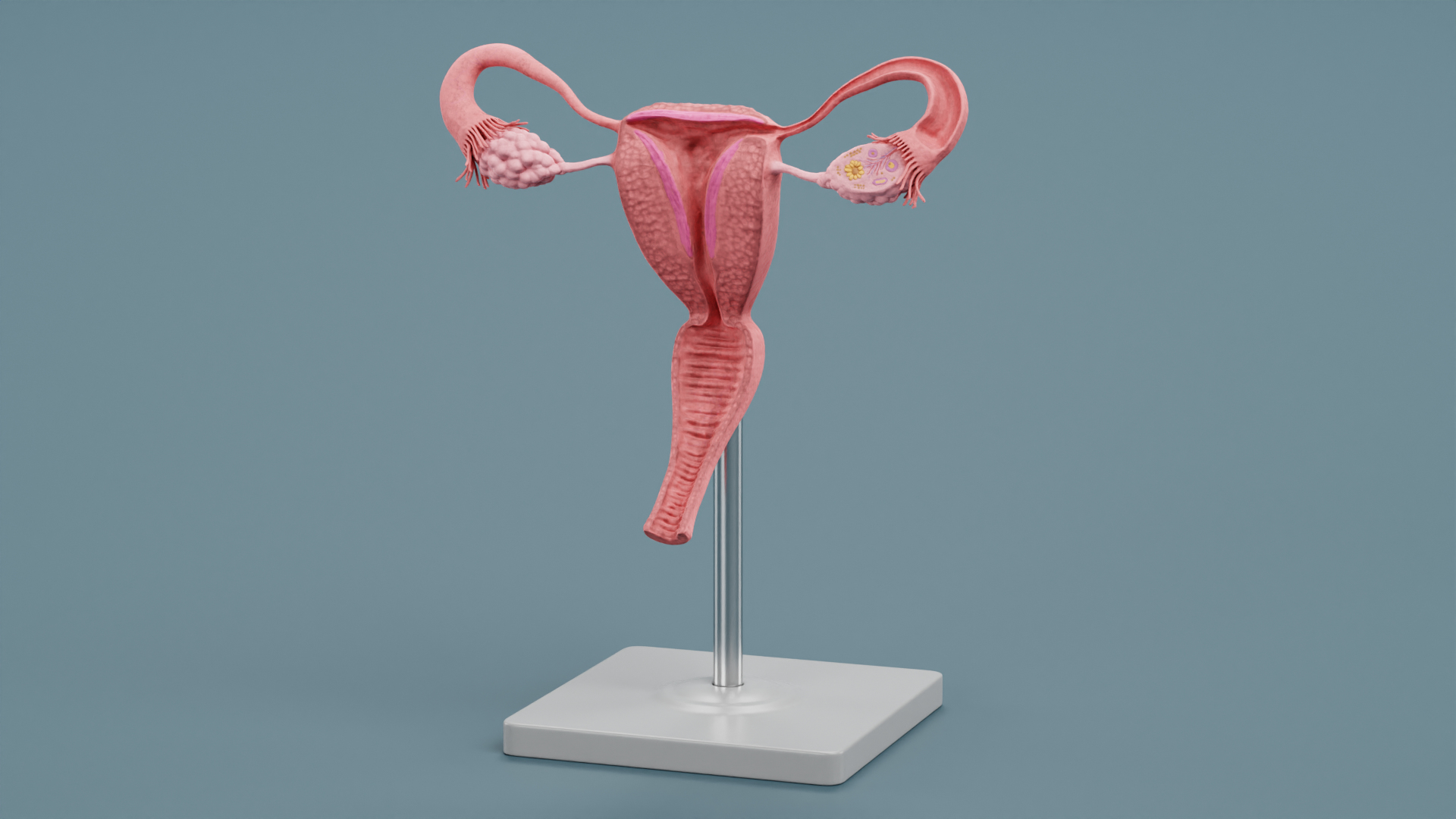 3D Uterus Model Model - TurboSquid 2026882