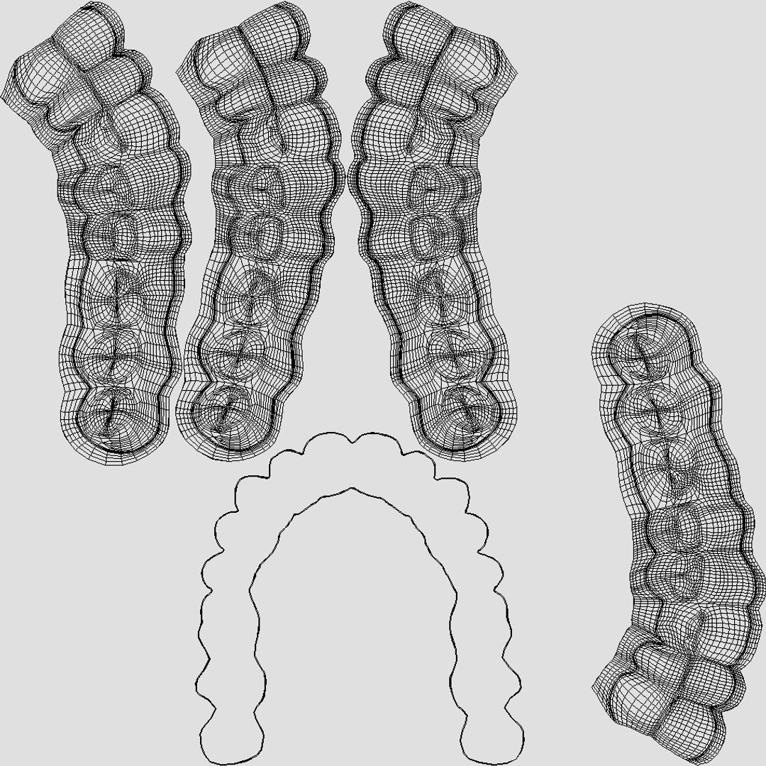 3D Dental Retainer - TurboSquid 1949083