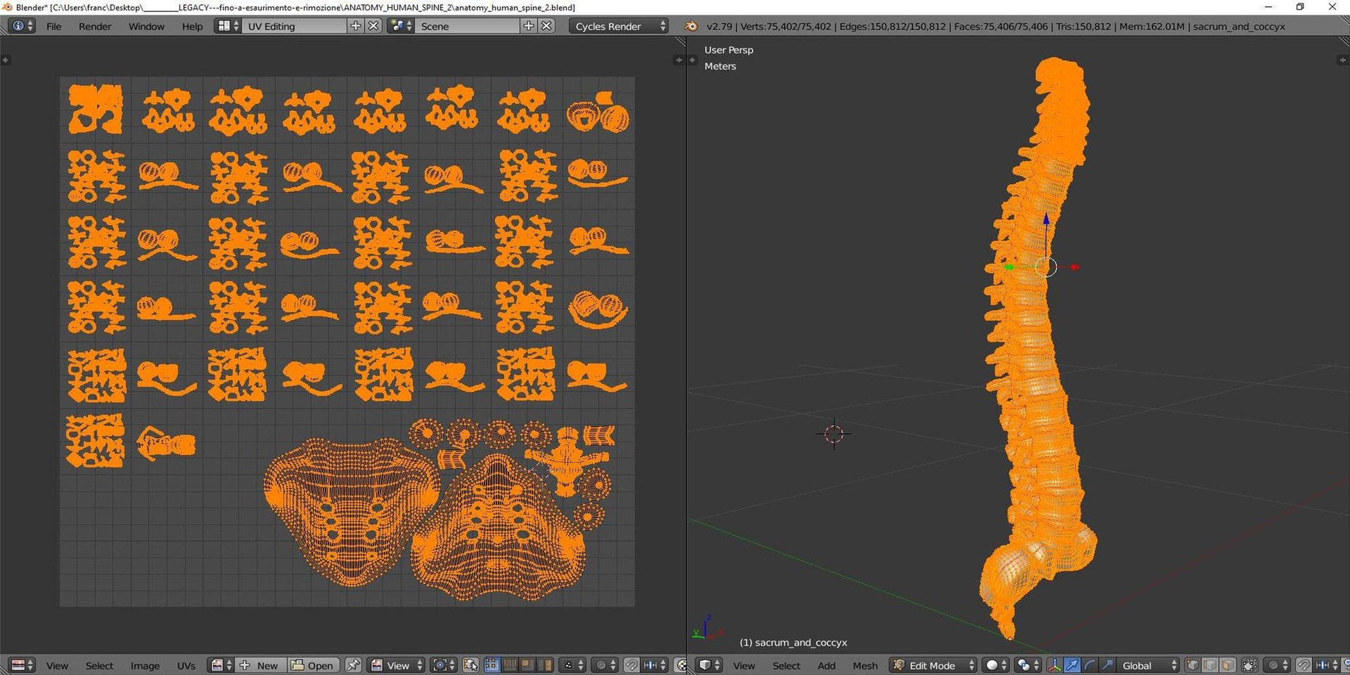 3D Human Spine 2 - TurboSquid 1170523
