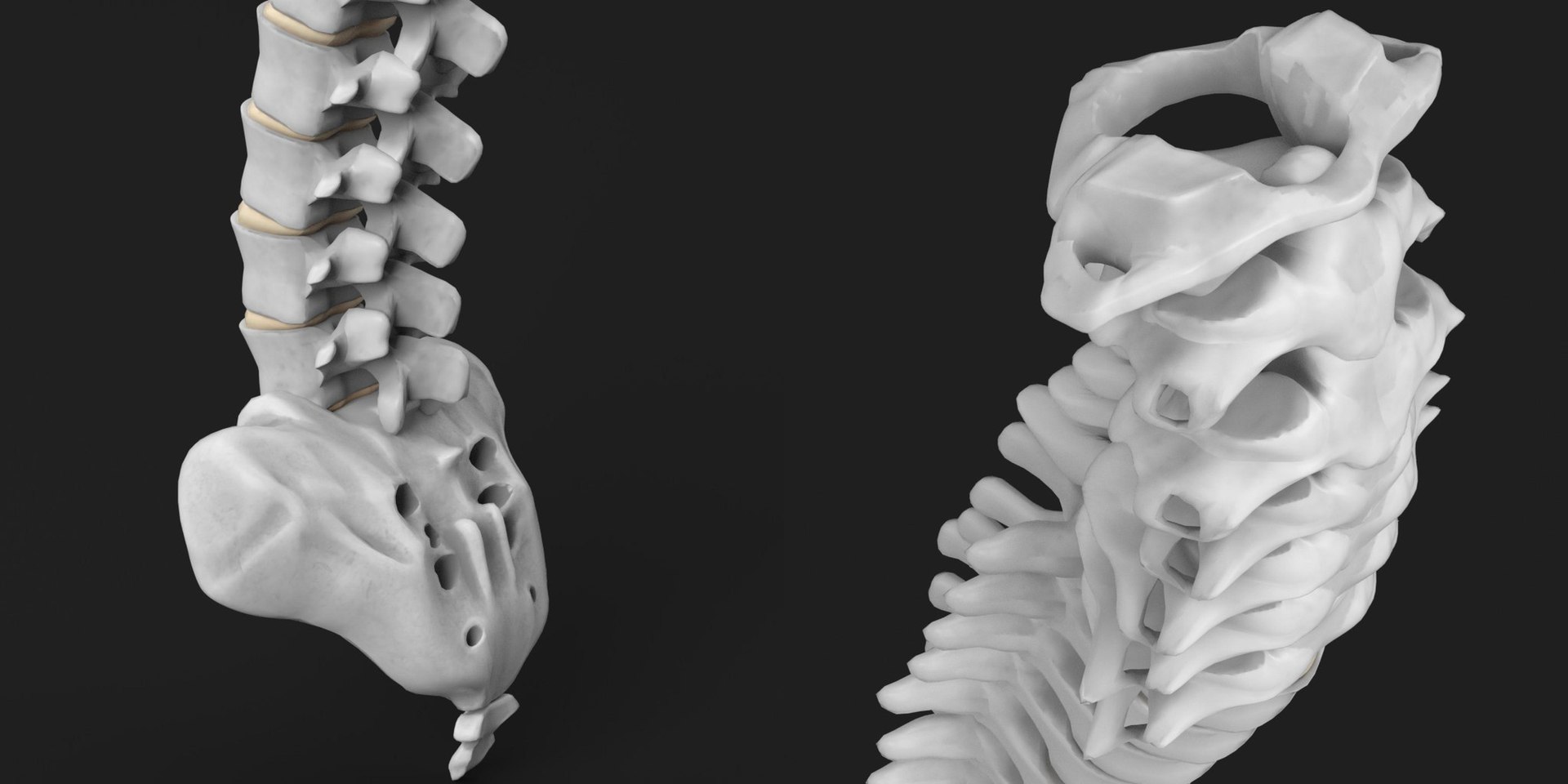 3D Human Spine 2 - TurboSquid 1170523