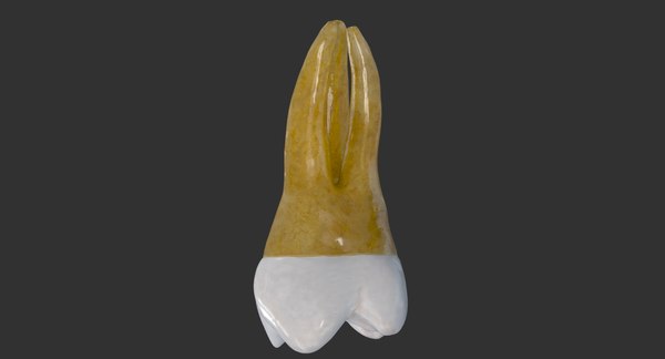 modelo 3d Tercer Molar superior izquierdo - TurboSquid 1253605