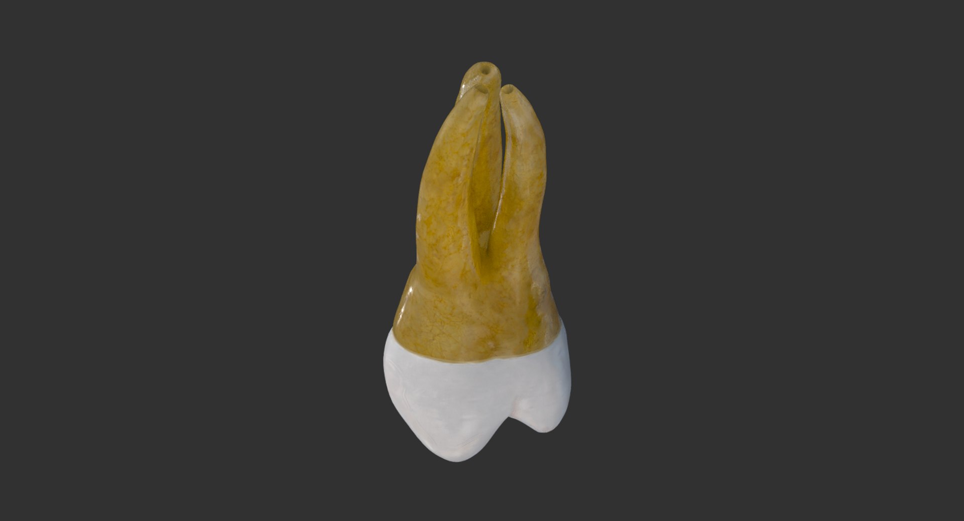 Upper Molar 3D Model - TurboSquid 1253605