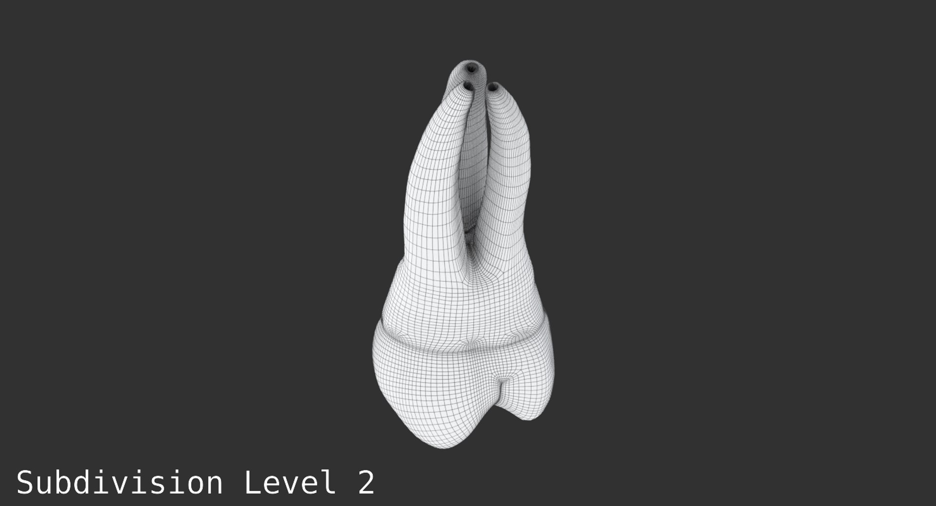 Upper molar 3D model - TurboSquid 1253605