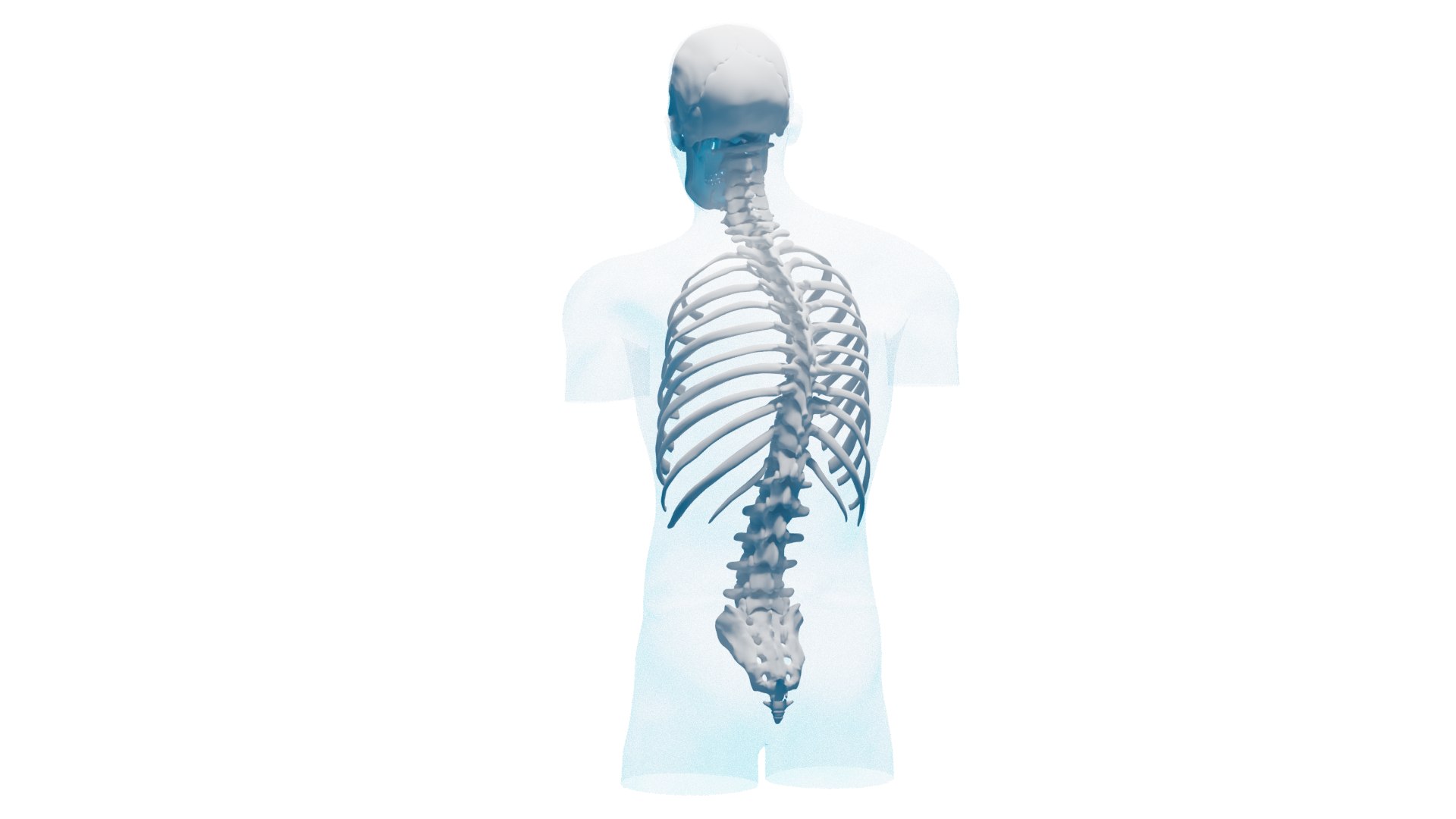 3D Scoliosis Skeleton Vs Normal Skeleton - TurboSquid 2128868