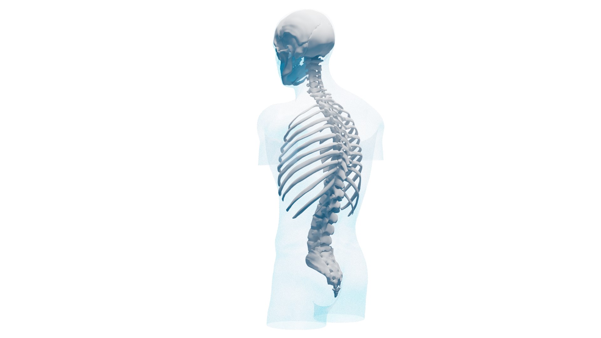 3D Scoliosis Skeleton Vs Normal Skeleton - TurboSquid 2128868
